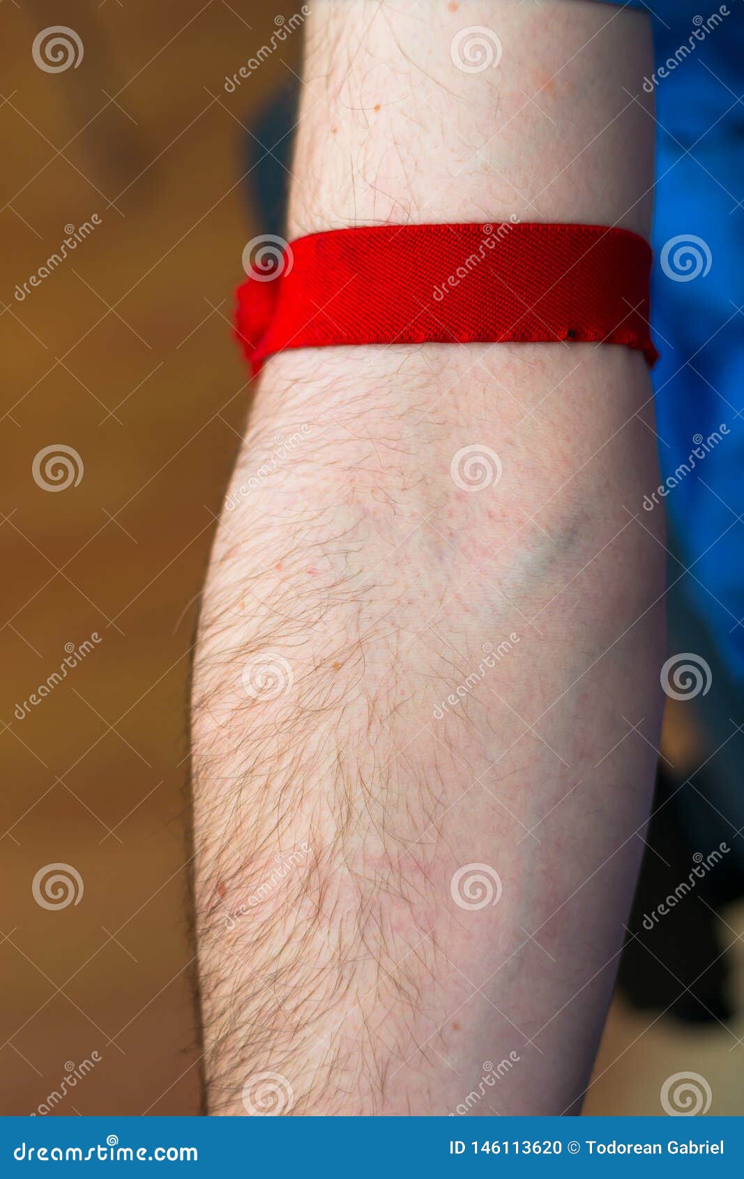The Red Tourniquet on a Man`s Hand Stock Photo - Image of collect ...