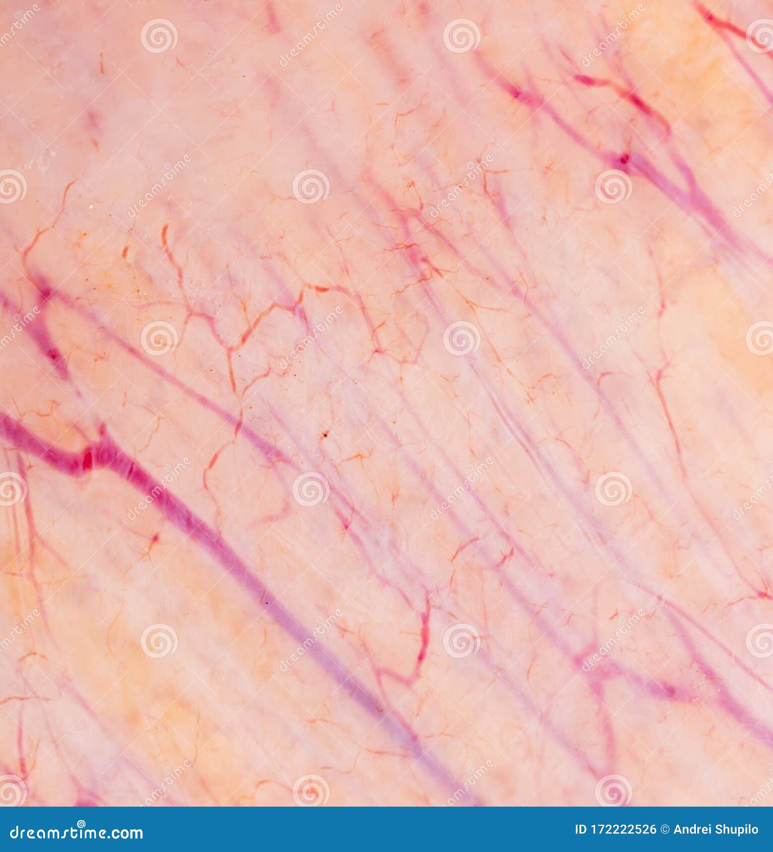 Red Veins on Fish Caviar As a Background Stock Photo - Image of texture ...