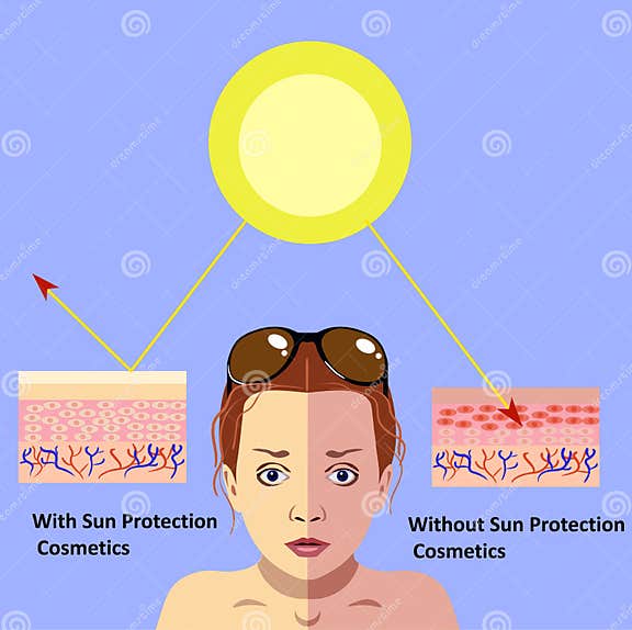 Redness On Woman Facial And Neck Skin Vector Illustration About Danger
