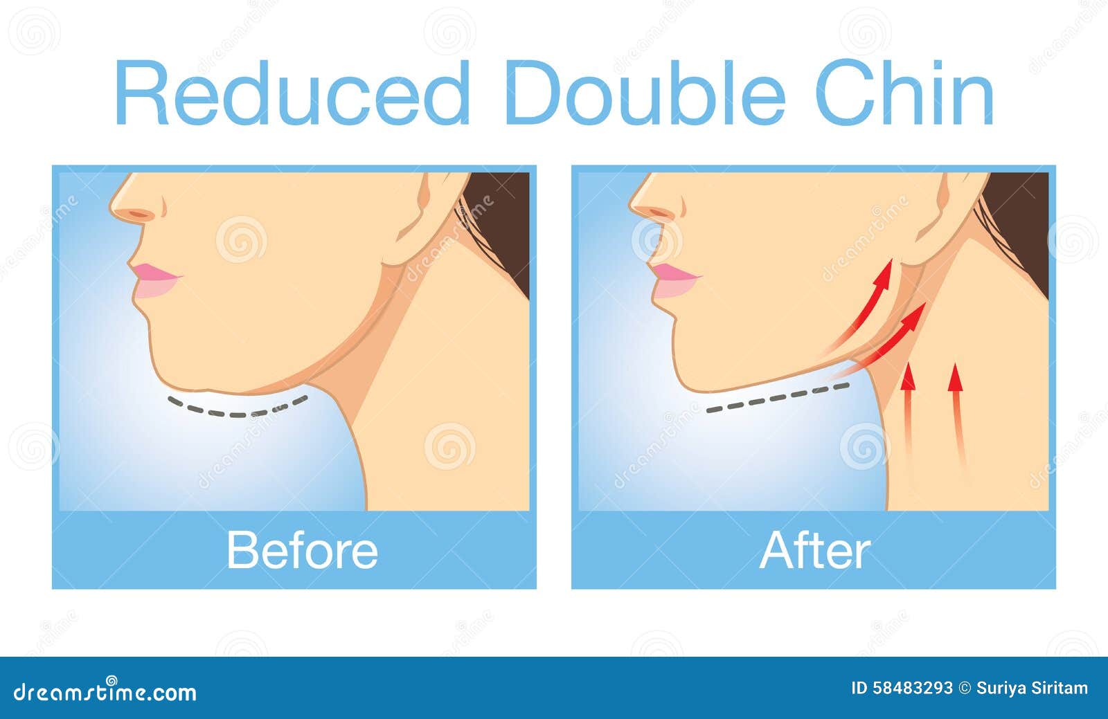 Chin Cartoons, Illustrations & Vector Stock Images - 17583 Pictures to ...