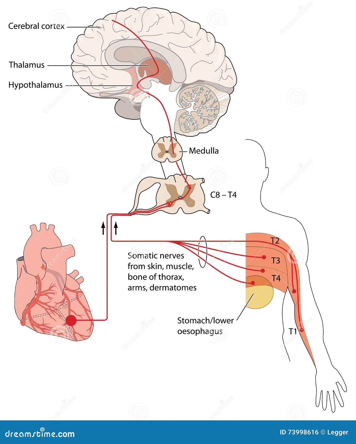 Referred Pain Signals Heart and Chest Stock Vector - Illustration of ... Referred Pain Signals Heart and Chest Stock Vector - Illustration of ...