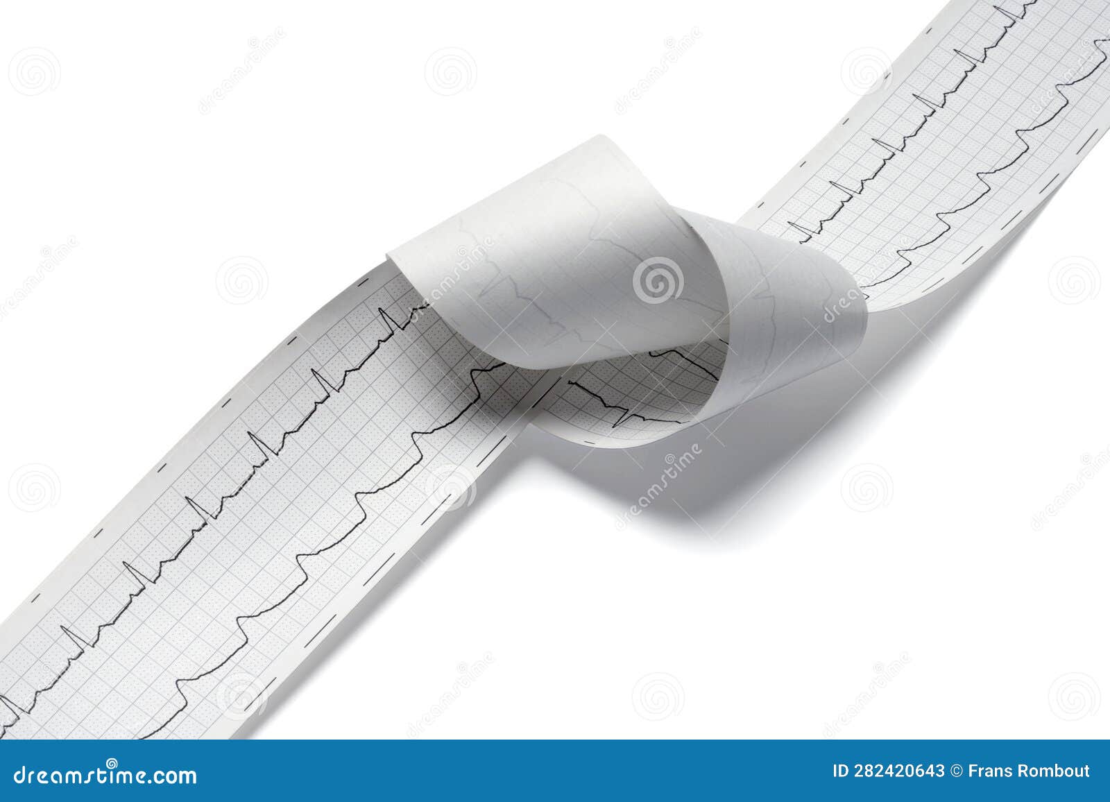 Regular Elektrocardiogram on White Background Close Up Stock Image ...