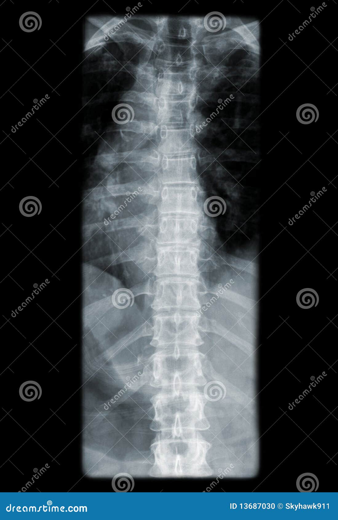 Regular Spine on Black Background Stock Photo - Image of bone, person ...