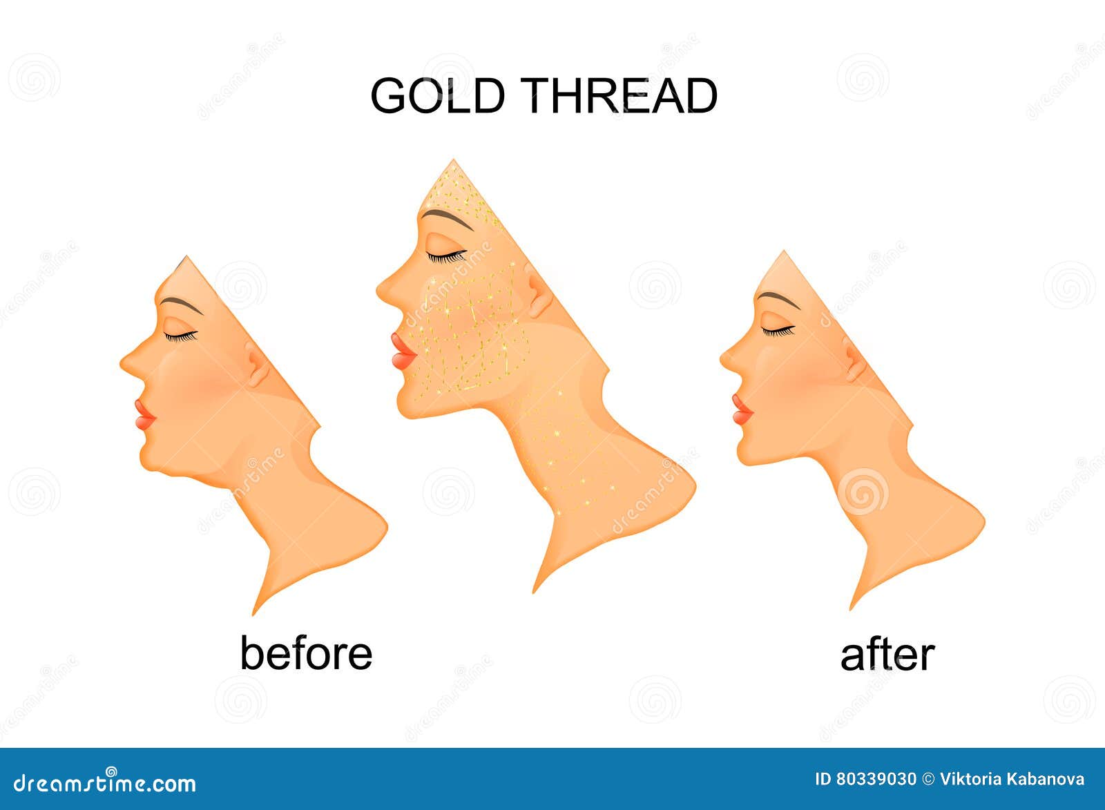 A Gold Thread Coiling On A Yellow Background Intricate Repeatable