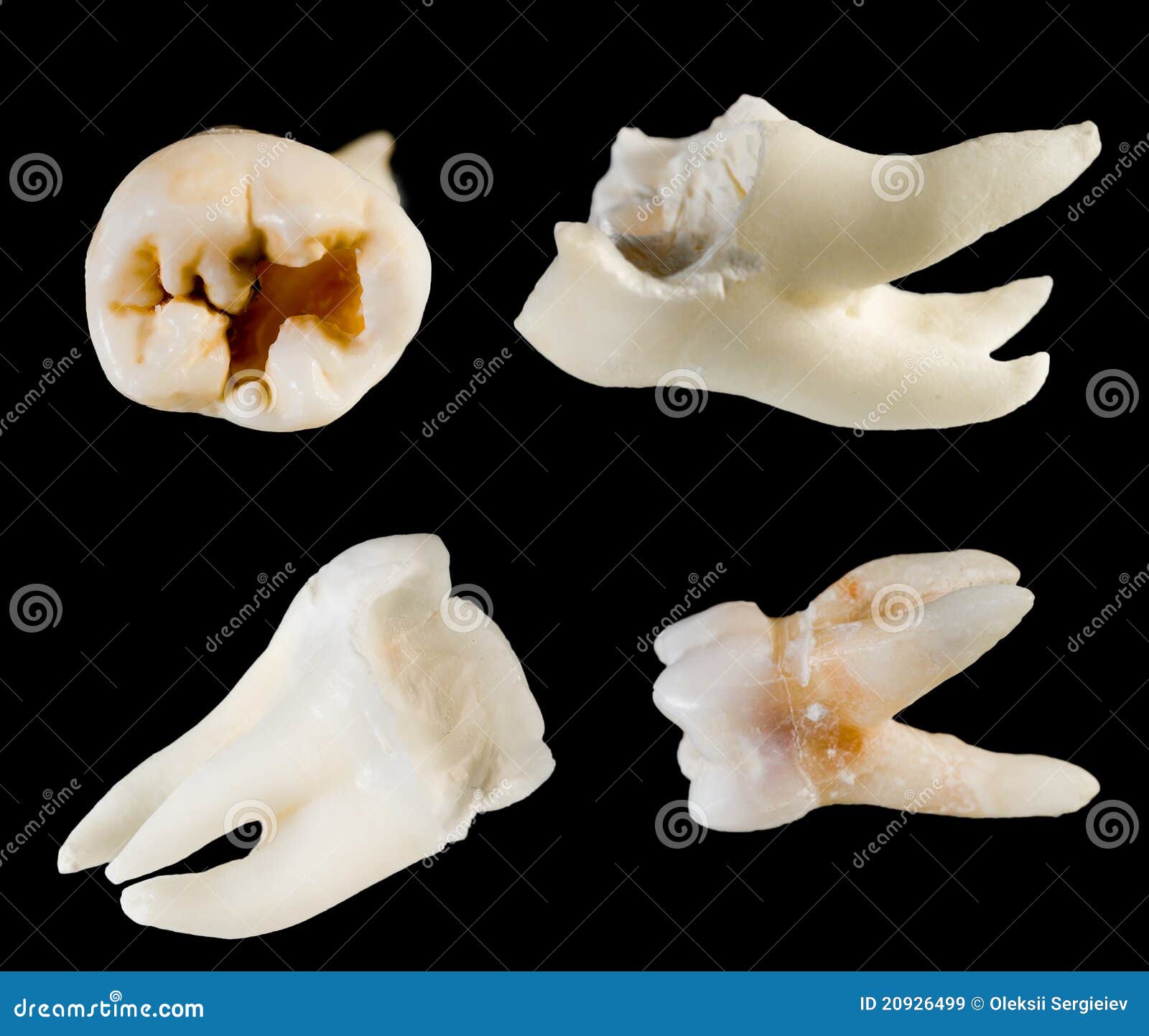 Remote root human teeth stock image. Image of medicine - 20926499