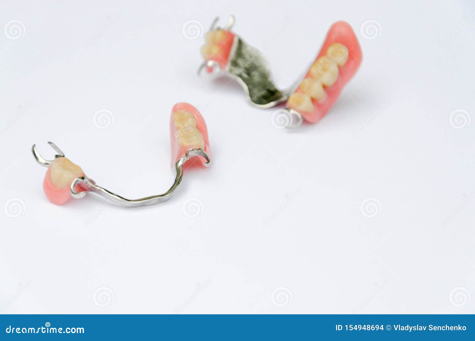 Removable Clasp Prosthesis on the Upper and Lower Jaw Stock Photo ...