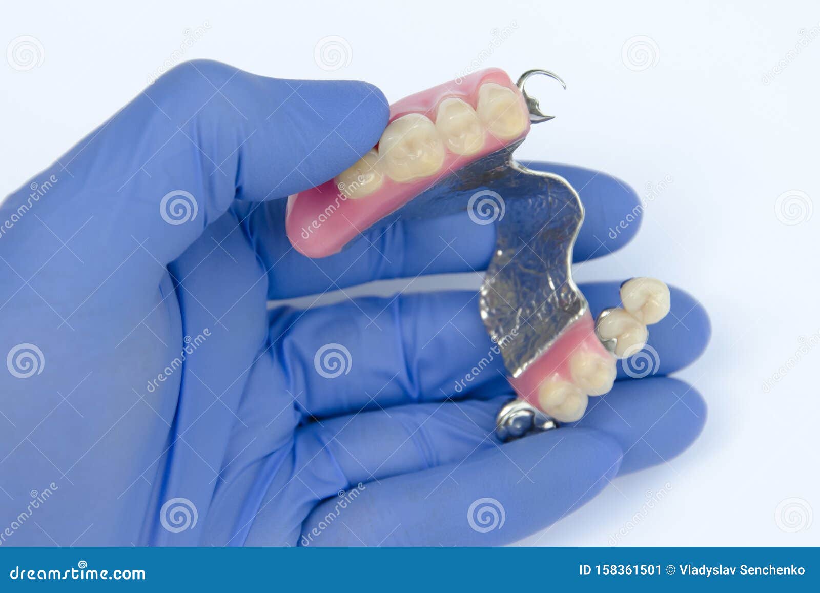 Removable Clasp Prosthesis in the Dentistâ€™s Hand Stock Image - Image ...