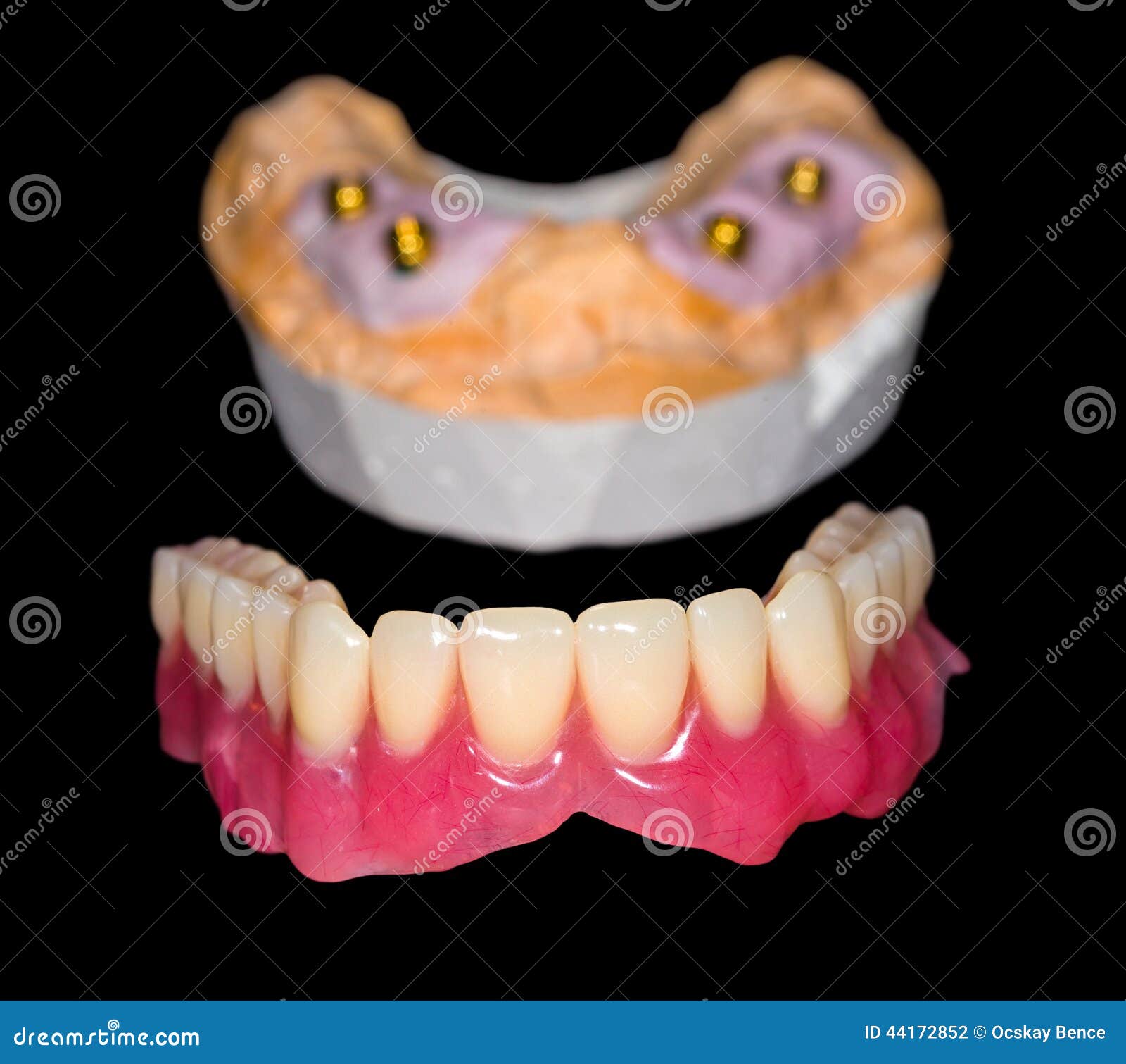 Removable denture stock photo. Image of model, lower - 44172852