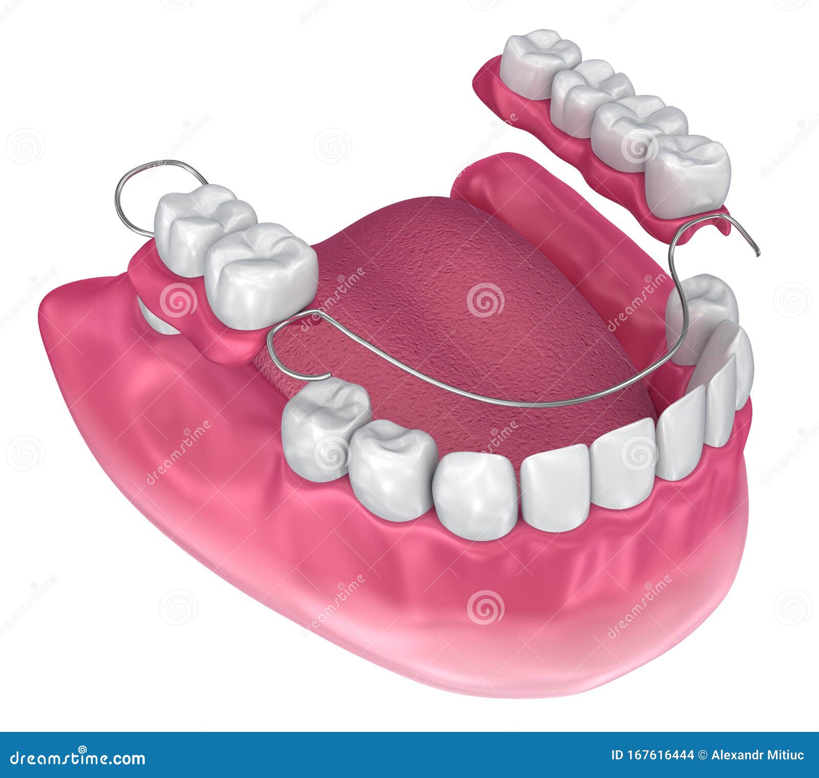 Partial Denture Icon In Trendy Design Style. Partial Denture Icon ...