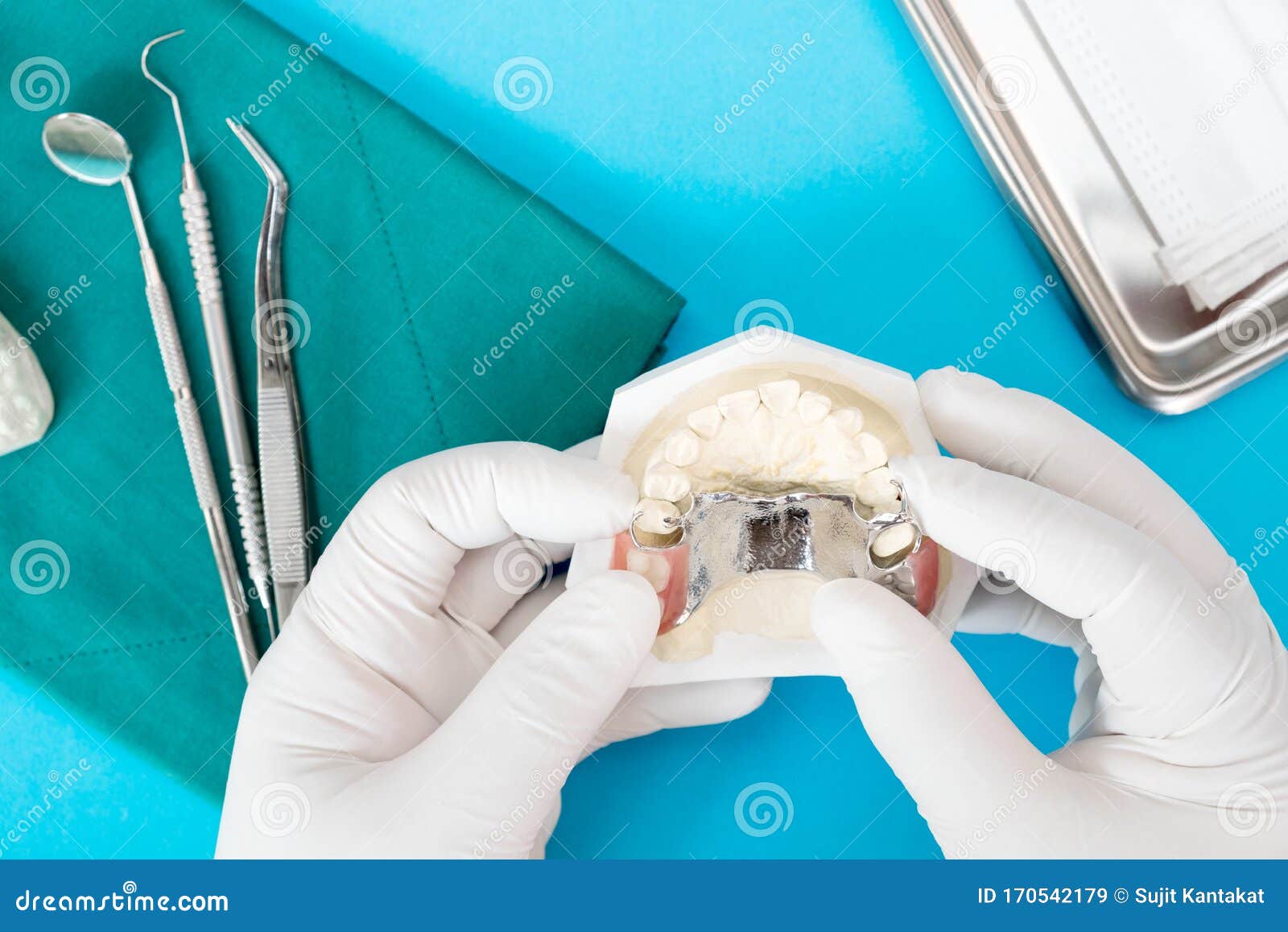 Removable Partial Denture RPD. Stock Image - Image of dentures ...