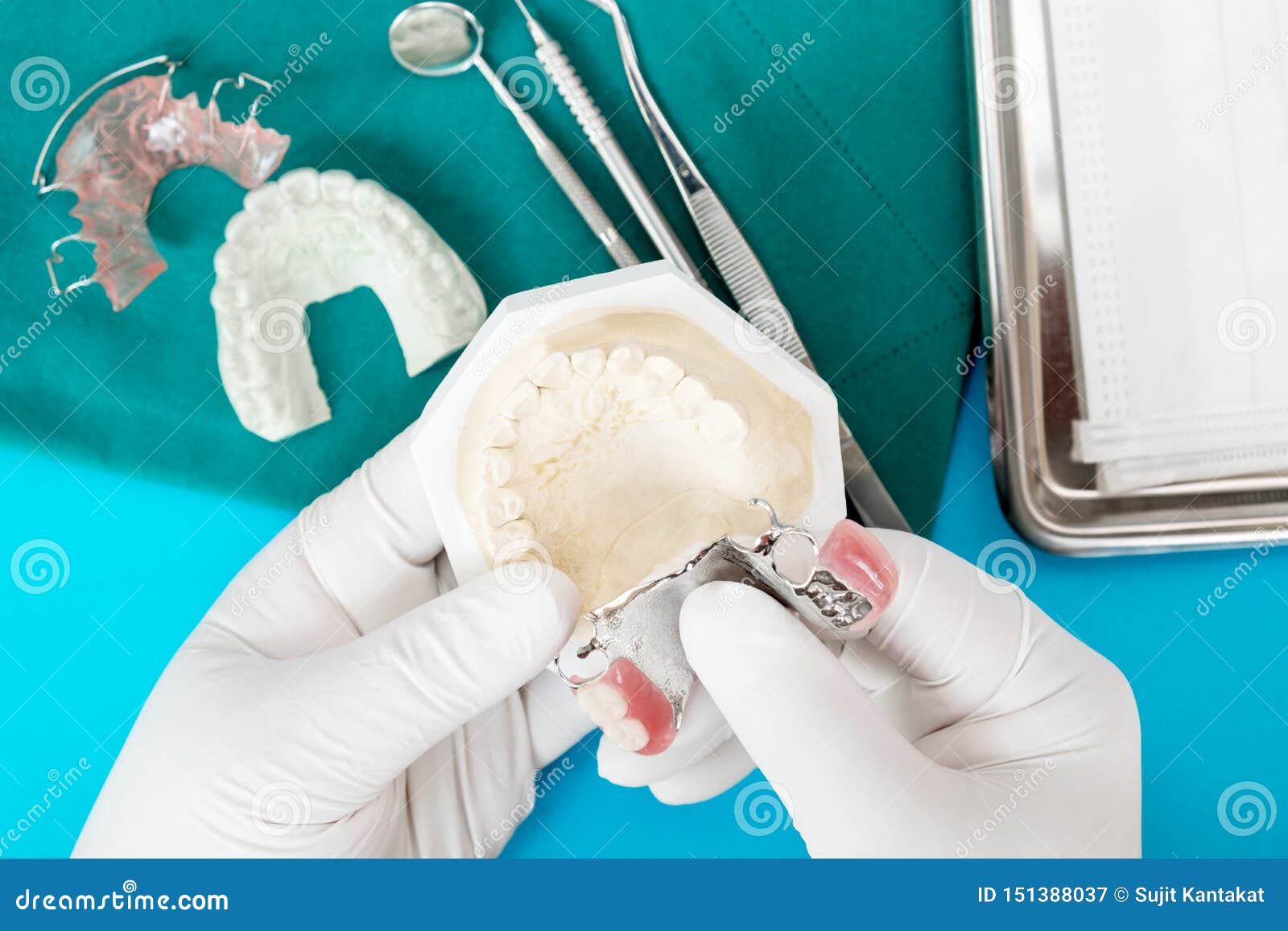 Removable Partial Denture RPD. Stock Image - Image of white, healthcare ...