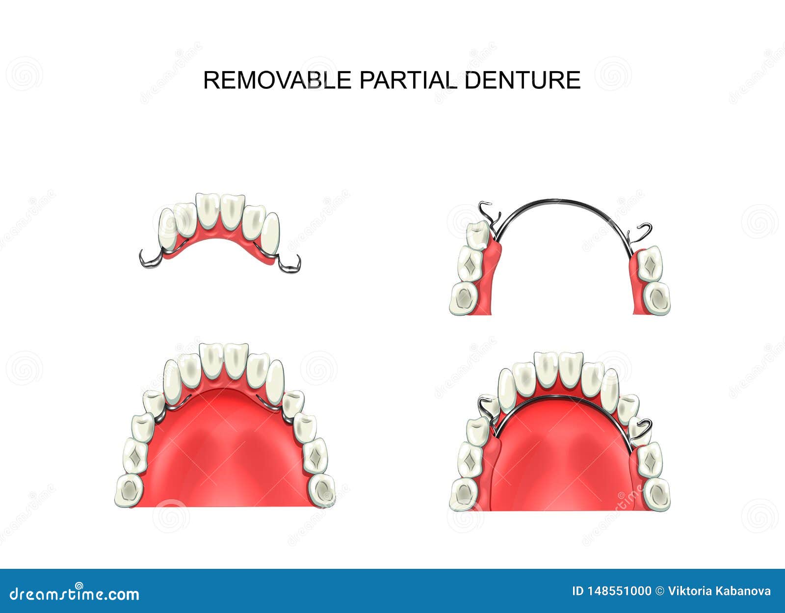 Partial Denture Linear Icon. Modern Outline Partial Denture Logo Vector ...