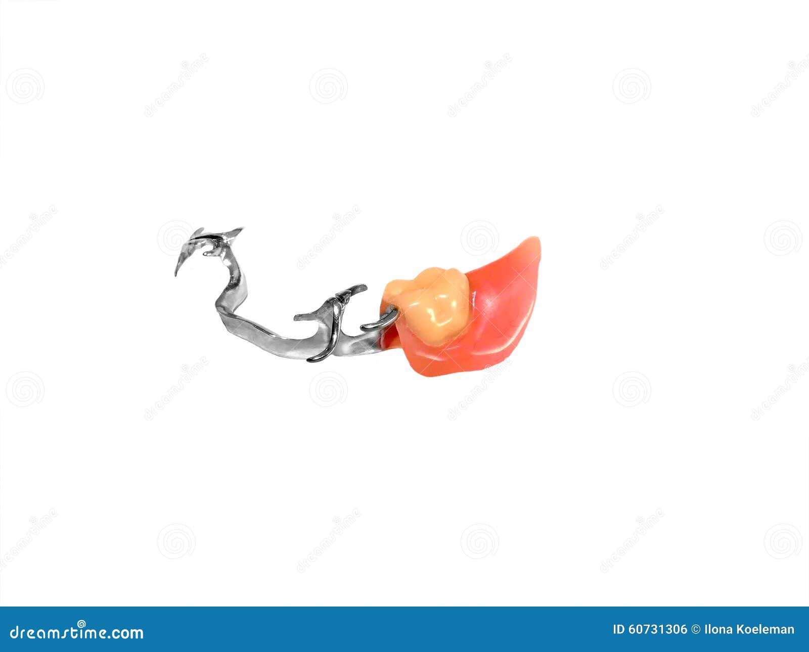Removable partial denture stock photo. Image of dentures - 60731306