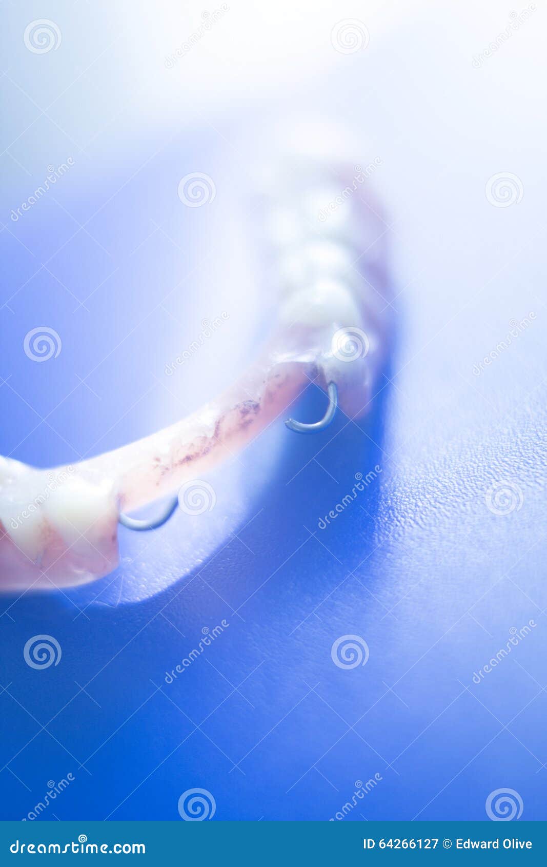 Removable Partial Denture RPD. Stock Image | CartoonDealer.com #150677191