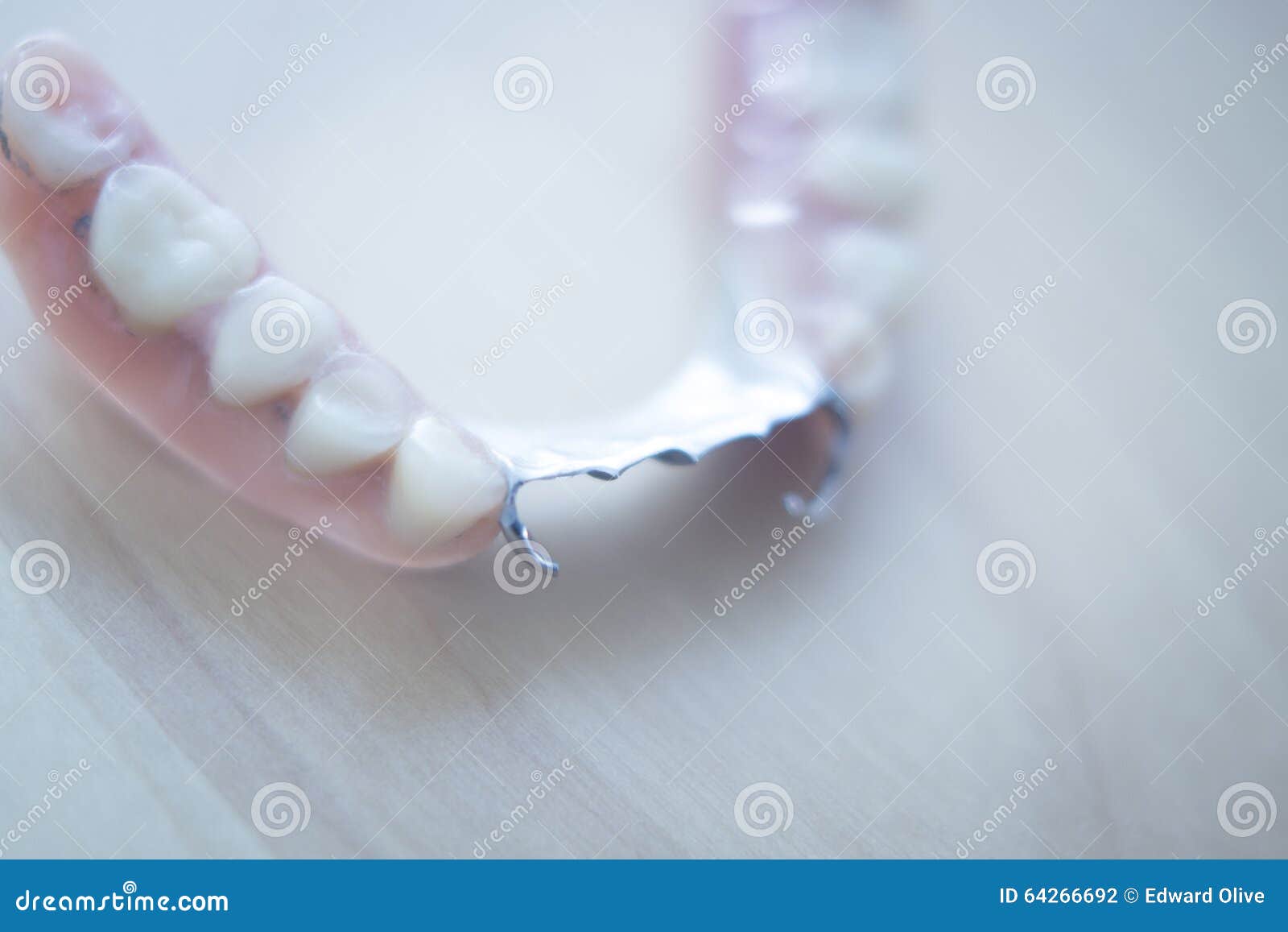 Removable Partial Metal Swinglock Upper Denture Opened On White ...