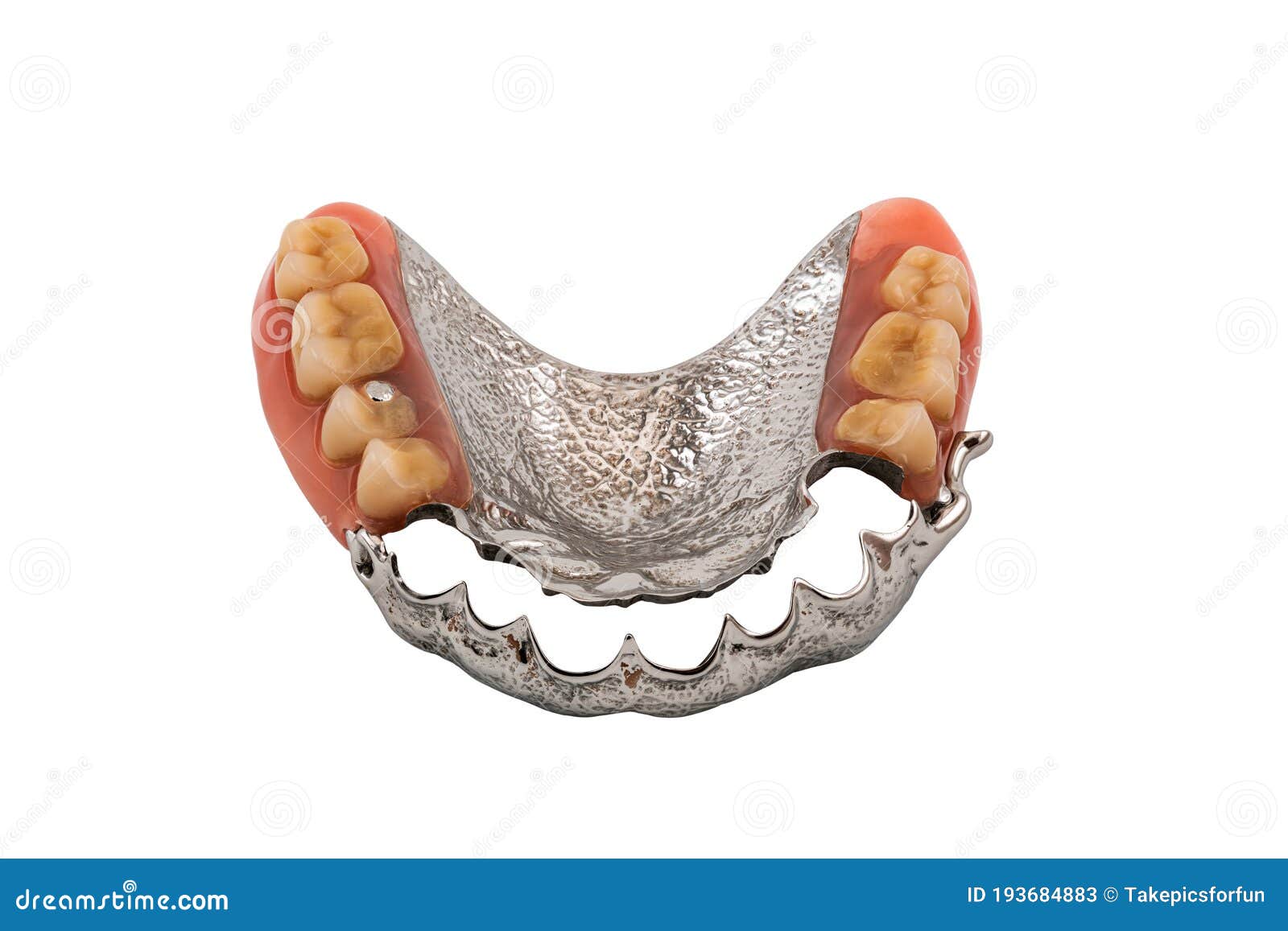 Fixed Partial Denture All Metal