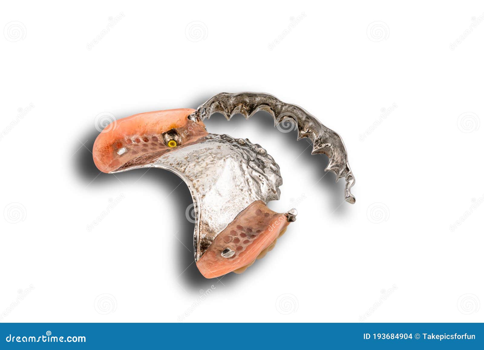 Removable Partial Metal Swinglock Upper Denture Opened on White ...