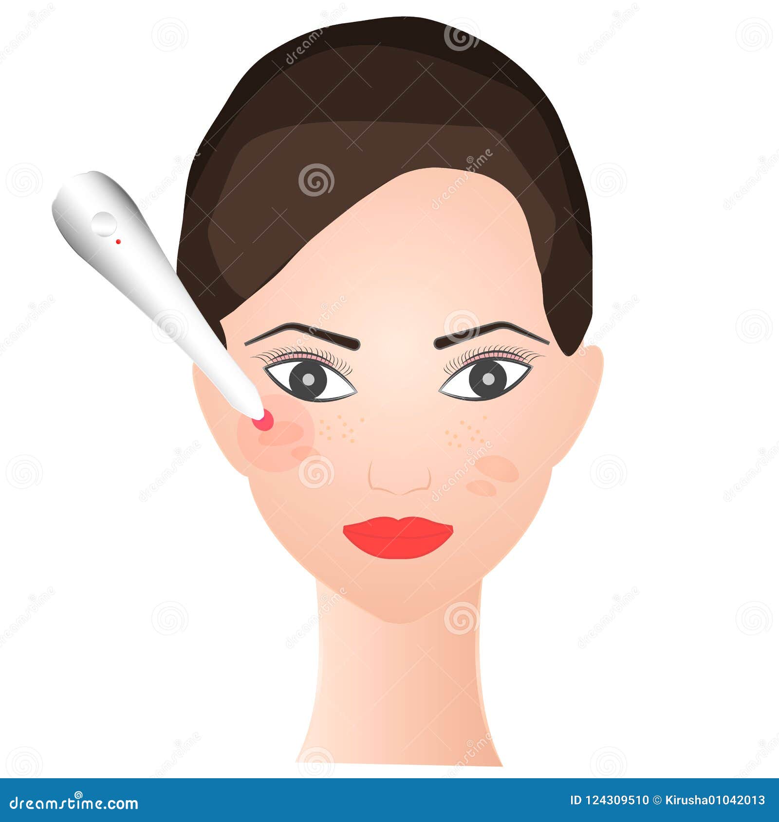 Pigmented Spots On The Skin. Skin Problem. Pigmentation. Closeup Brown ...