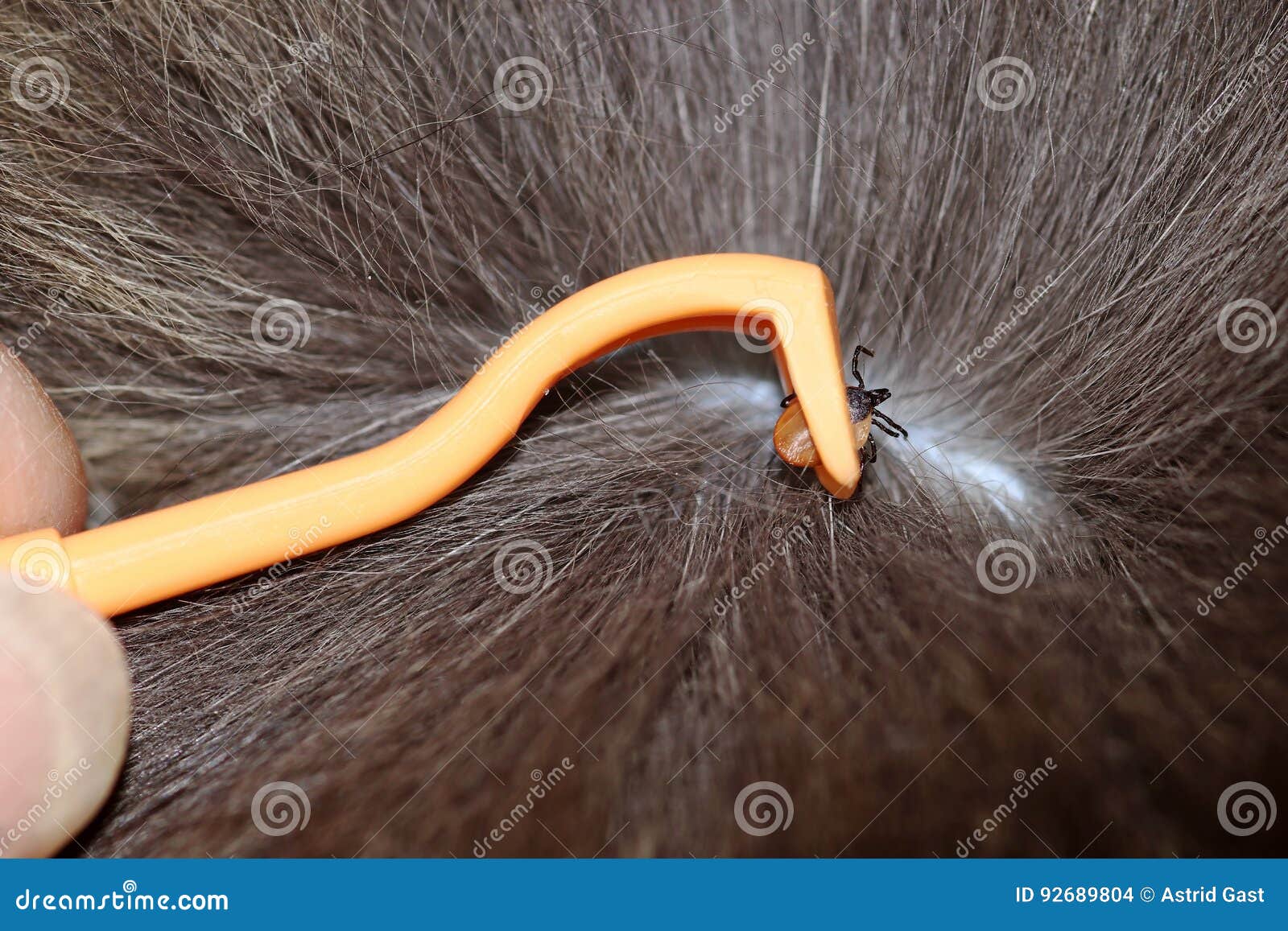 Tick Removal From Humans