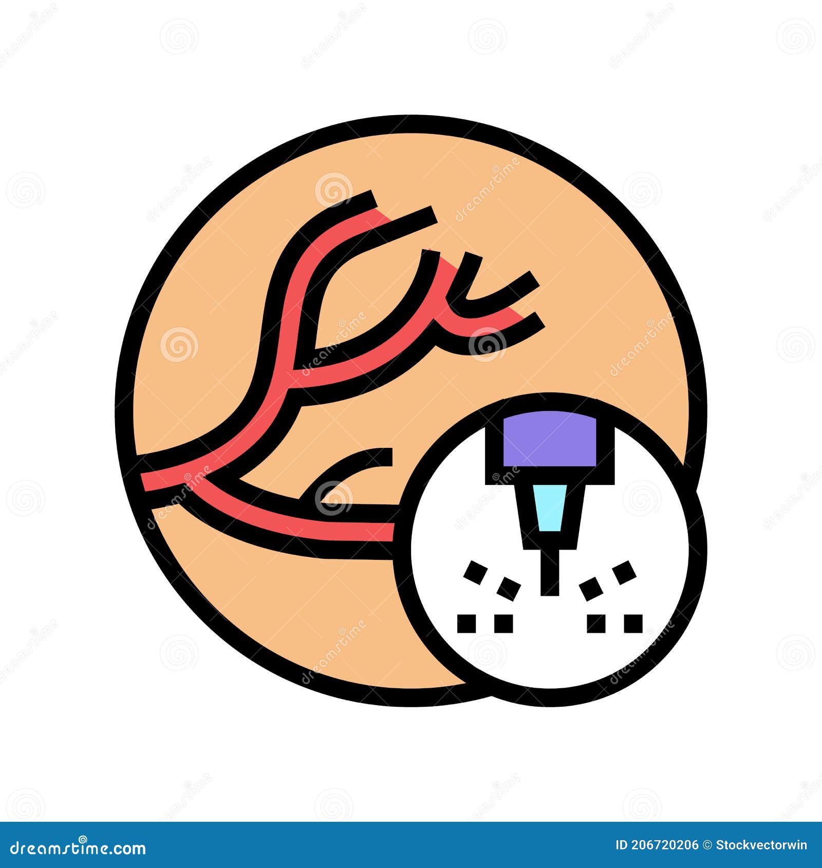 Removal of Vascular Pathologies Color Icon Vector Illustration Stock ...