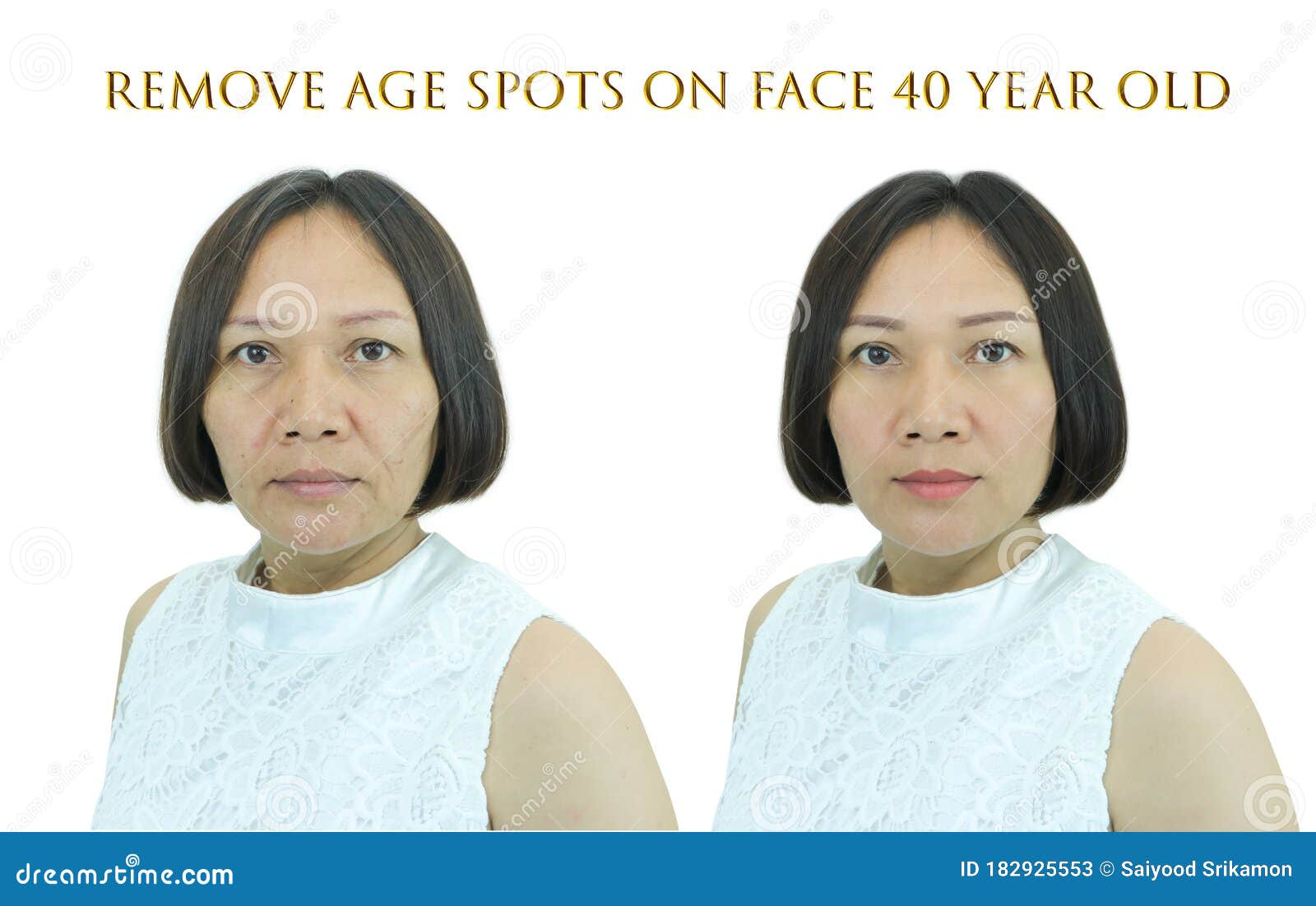 Before and after Remove Age Stock Image - Image of asia, lady: 182925553