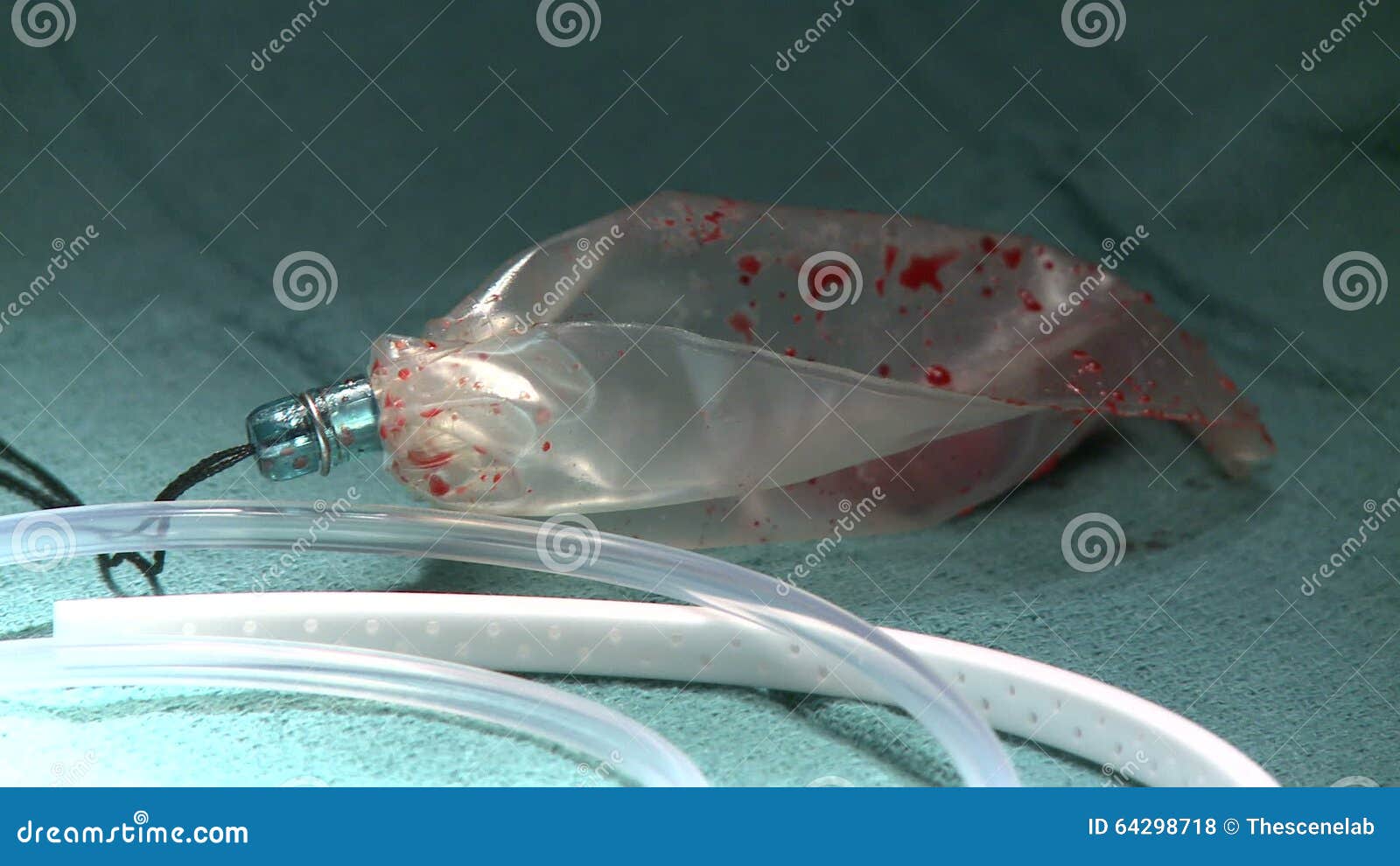 Removed organ (3 of 3) stock footage. Video of medical - 64298718