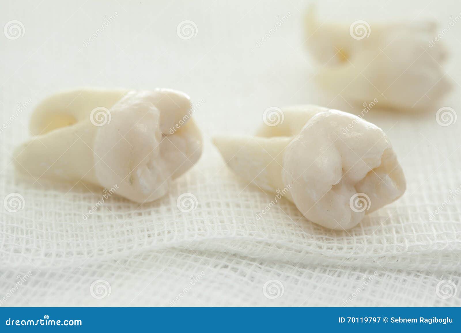Removed Wisdom Tooth on White Stock Image - Image of operation, loss ...