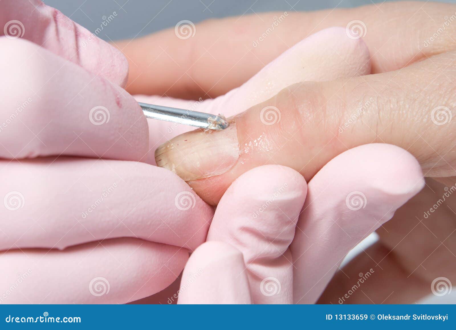 Removing Cuticle from the Nail Stock Image - Image of nail, beauty ...