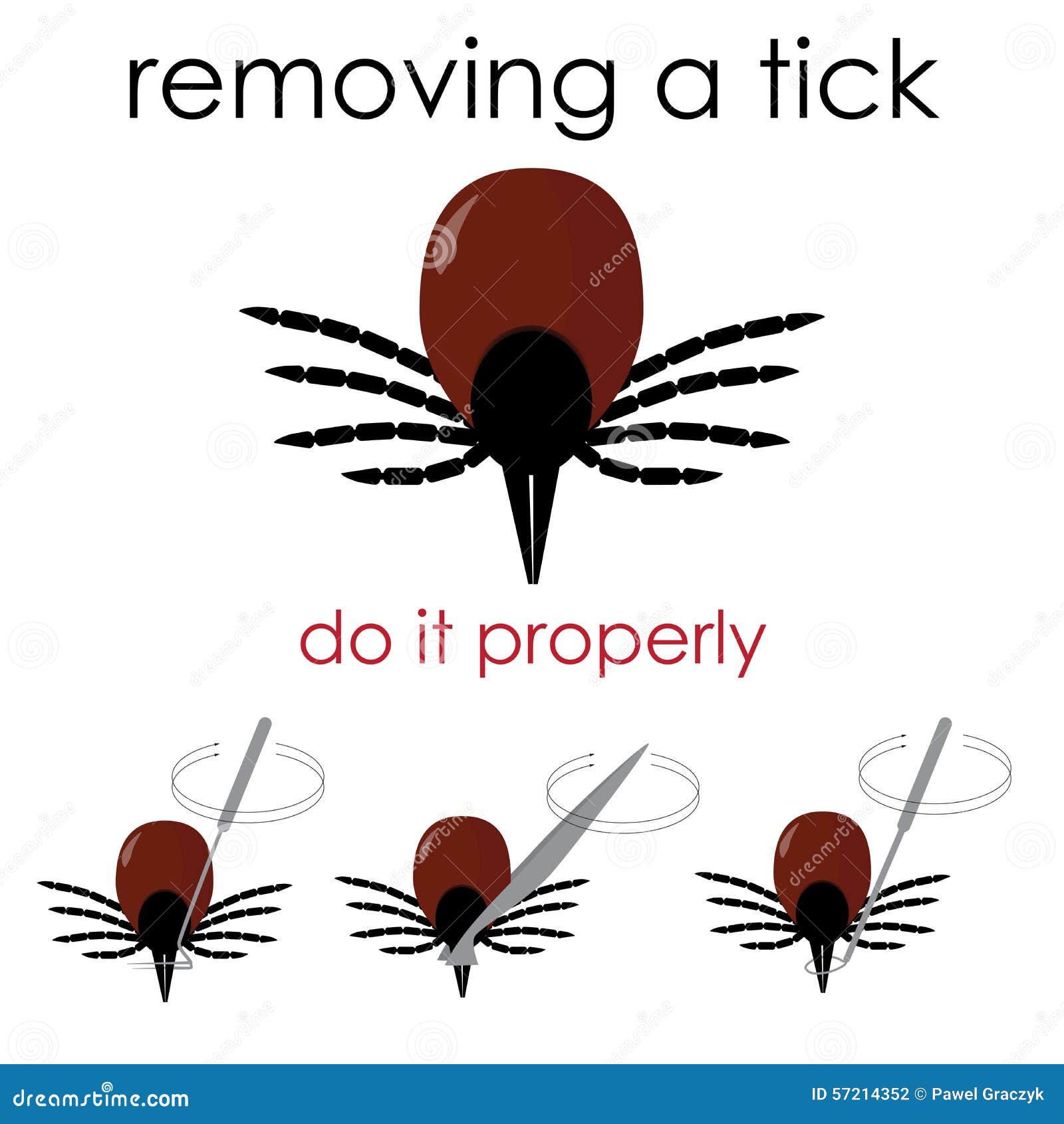How To Remove A Tick. The Correct Way Using Forceps. 3D-rendering ...
