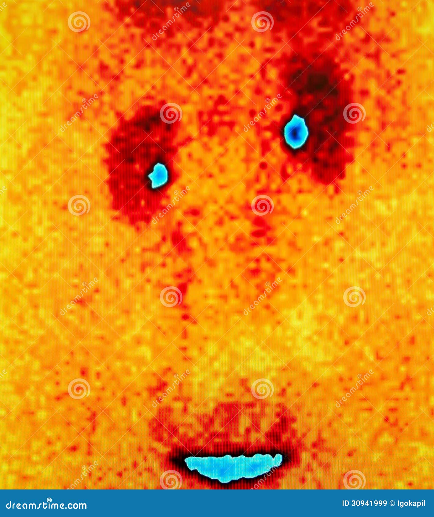 Normal Renal Flow,nuclear Medicine Stock Image | CartoonDealer.com ...