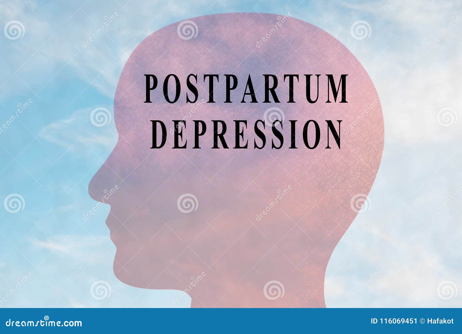 POSTPARTUM DEPRESSION - Mental Concept Stock Illustration ...