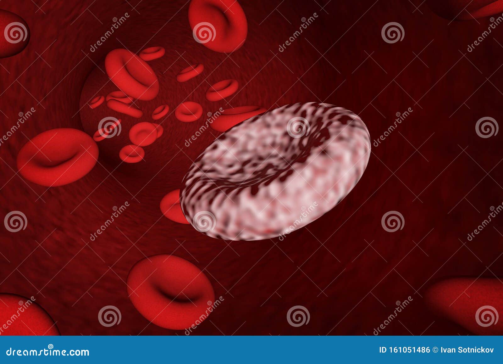 Renderer 3d. Sick Red Blood Cell In The Artery Stock Photography ...