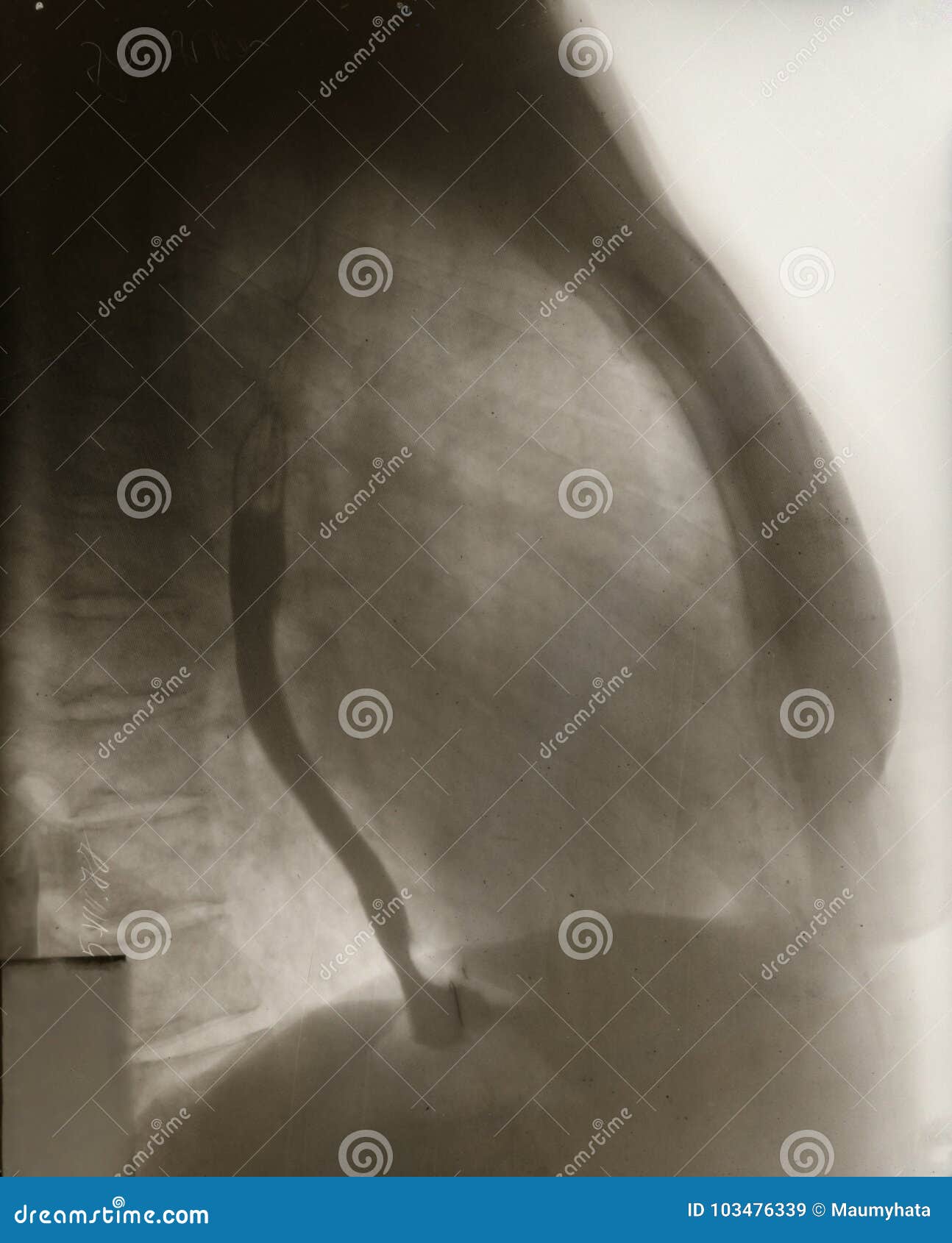 Rengen picture bone stock image. Image of human, health - 103476339