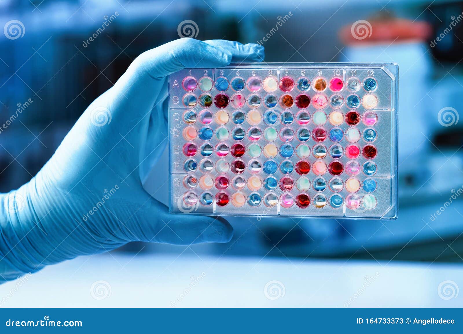 Researcher Hand Holding Microplate for Analytical Research Stock Image ...