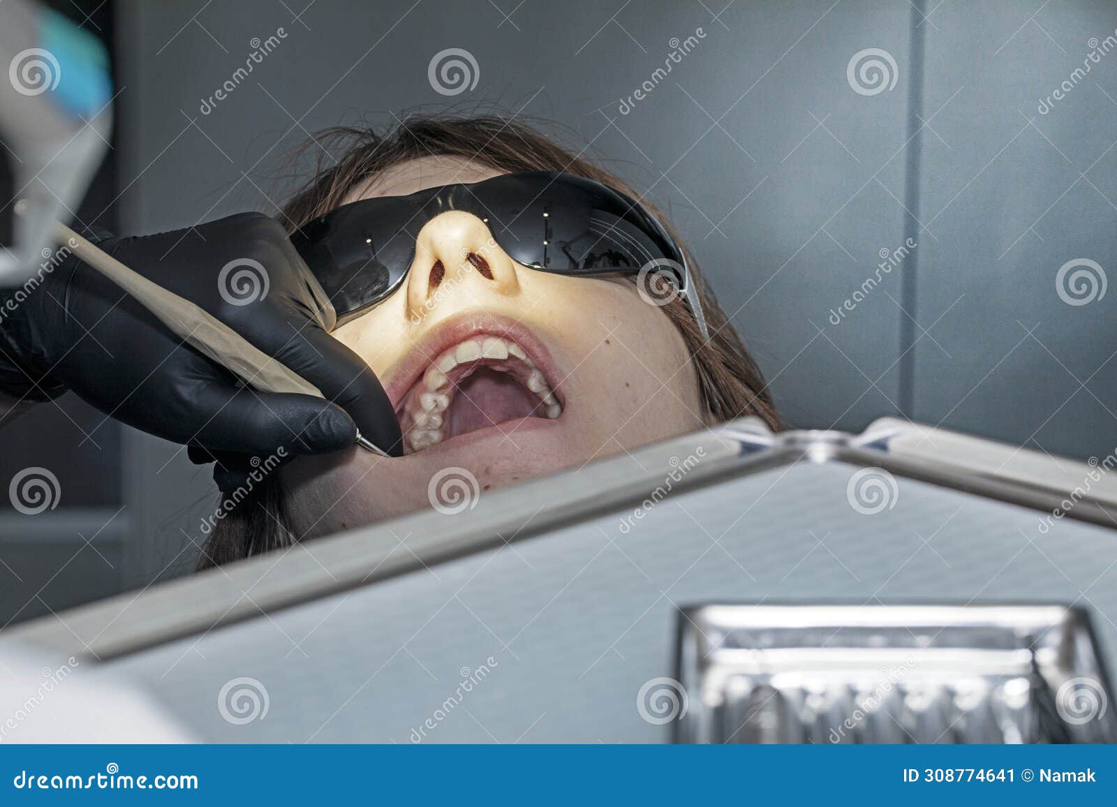 Restoration of a Damaged Tooth at the Dentist. Care and Stock Image ...