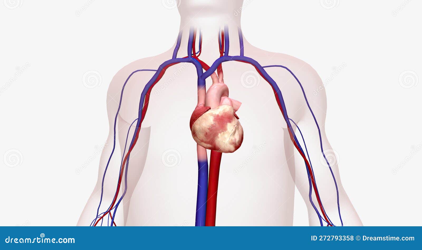 The In Heart Catheterization Through The Radial Artery, The Cath Stock ...