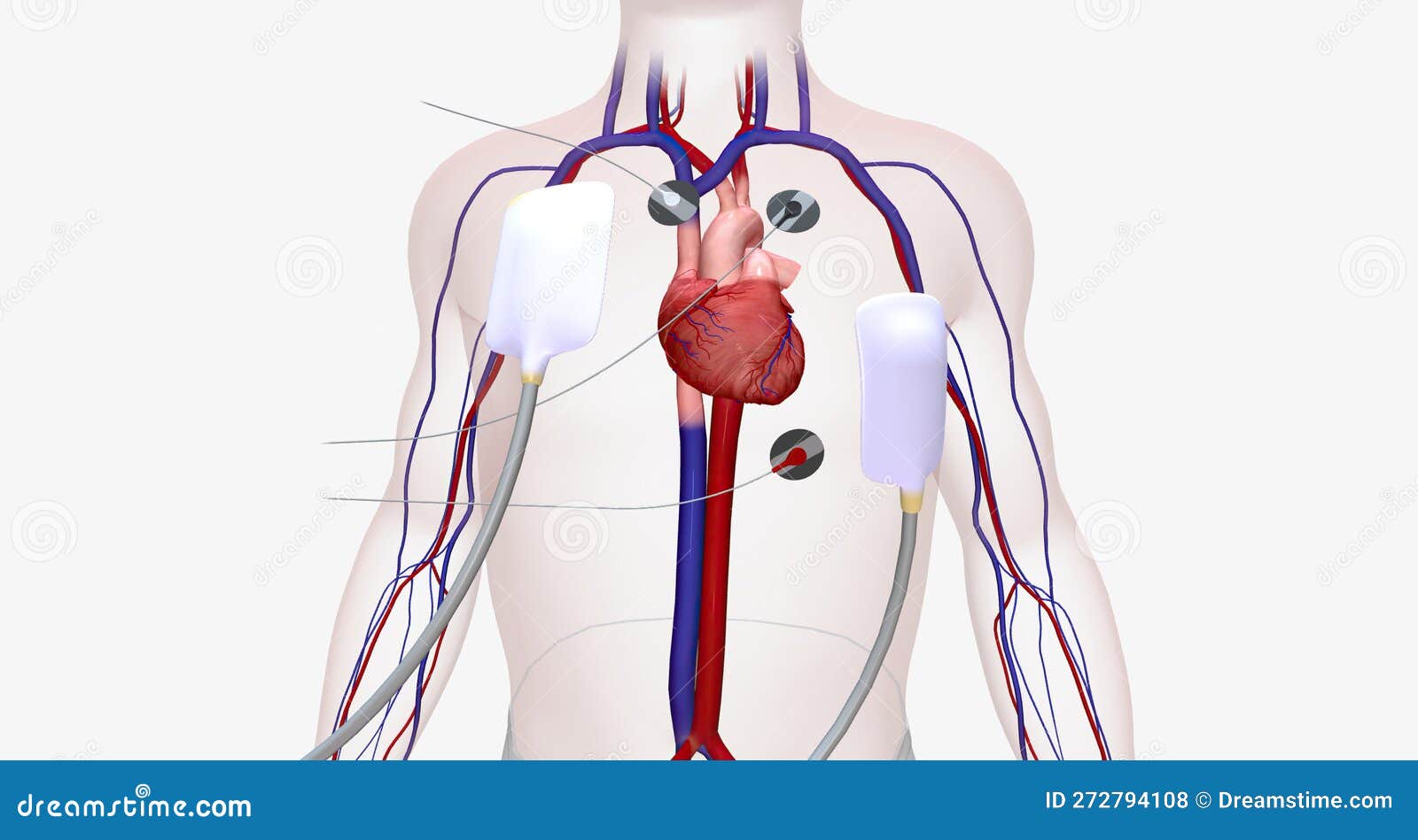 Restoration of Regular Heart Rhythm Stock Illustration - Illustration ...
