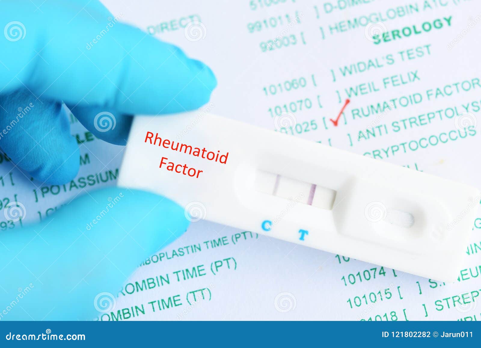 Resultado De La Prueba Positivo Del Factor Reumatoide Foto de archivo ...