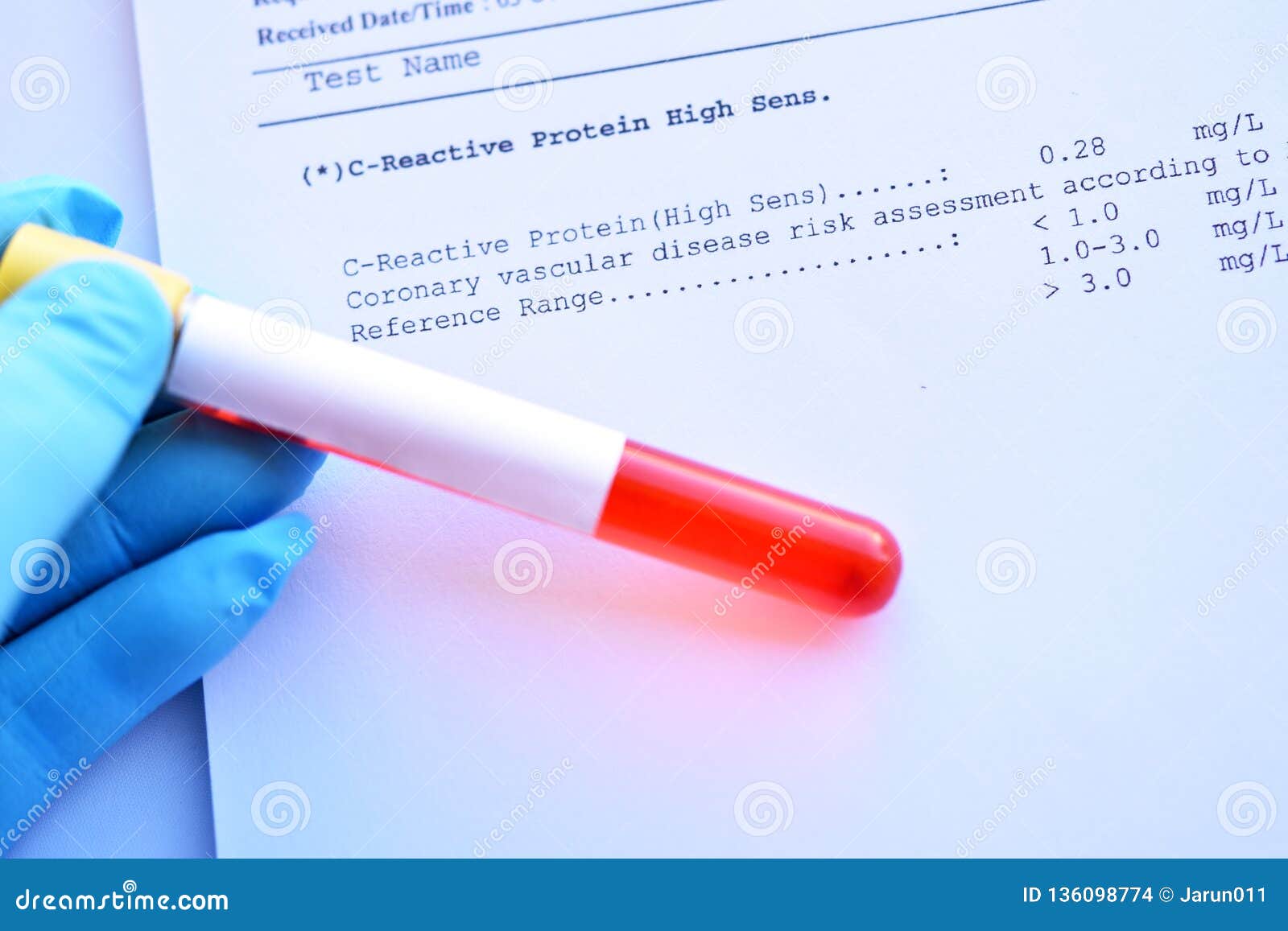 Resultado Normal De La Proteína C-reactiva Foto de archivo - Imagen de ...