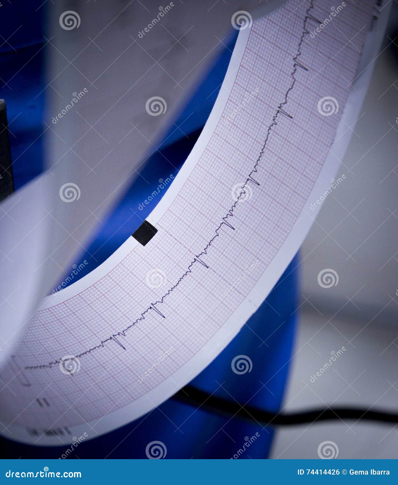Results Electrocardiogram in Paper Stock Photo - Image of diagnose ...