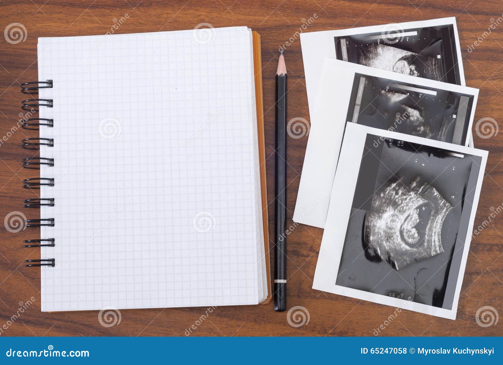 Results of Ultrasound Examination and Notebook Stock Photo - Image of ...