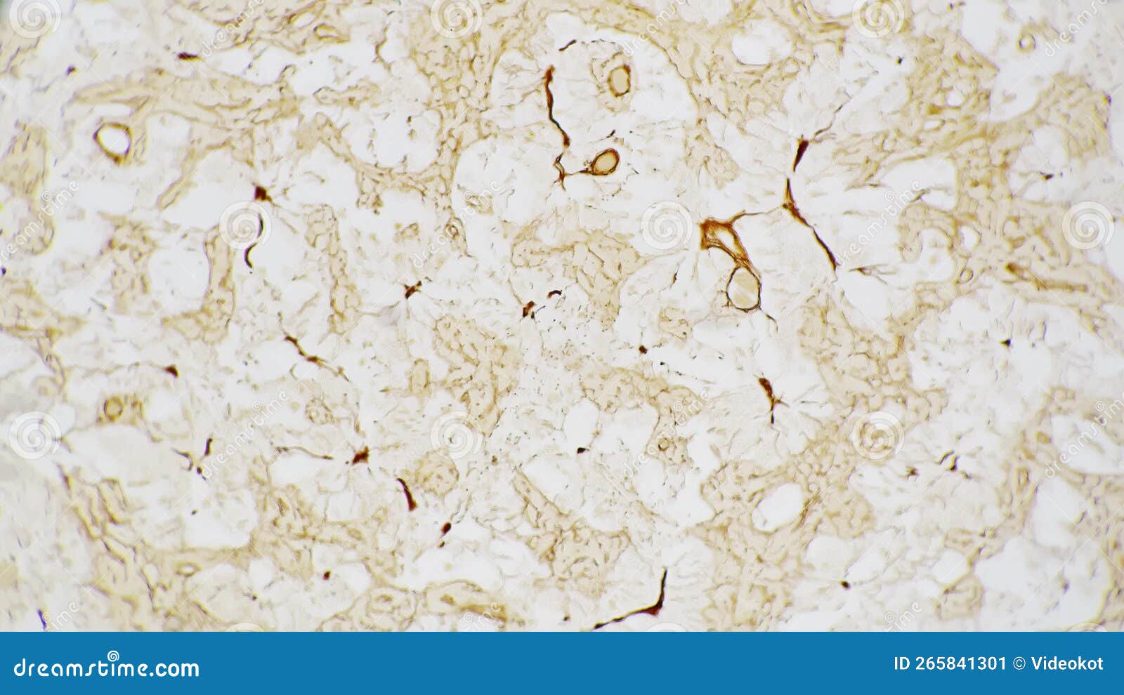 Reticular Stock Footage & Videos - 16 Stock Videos