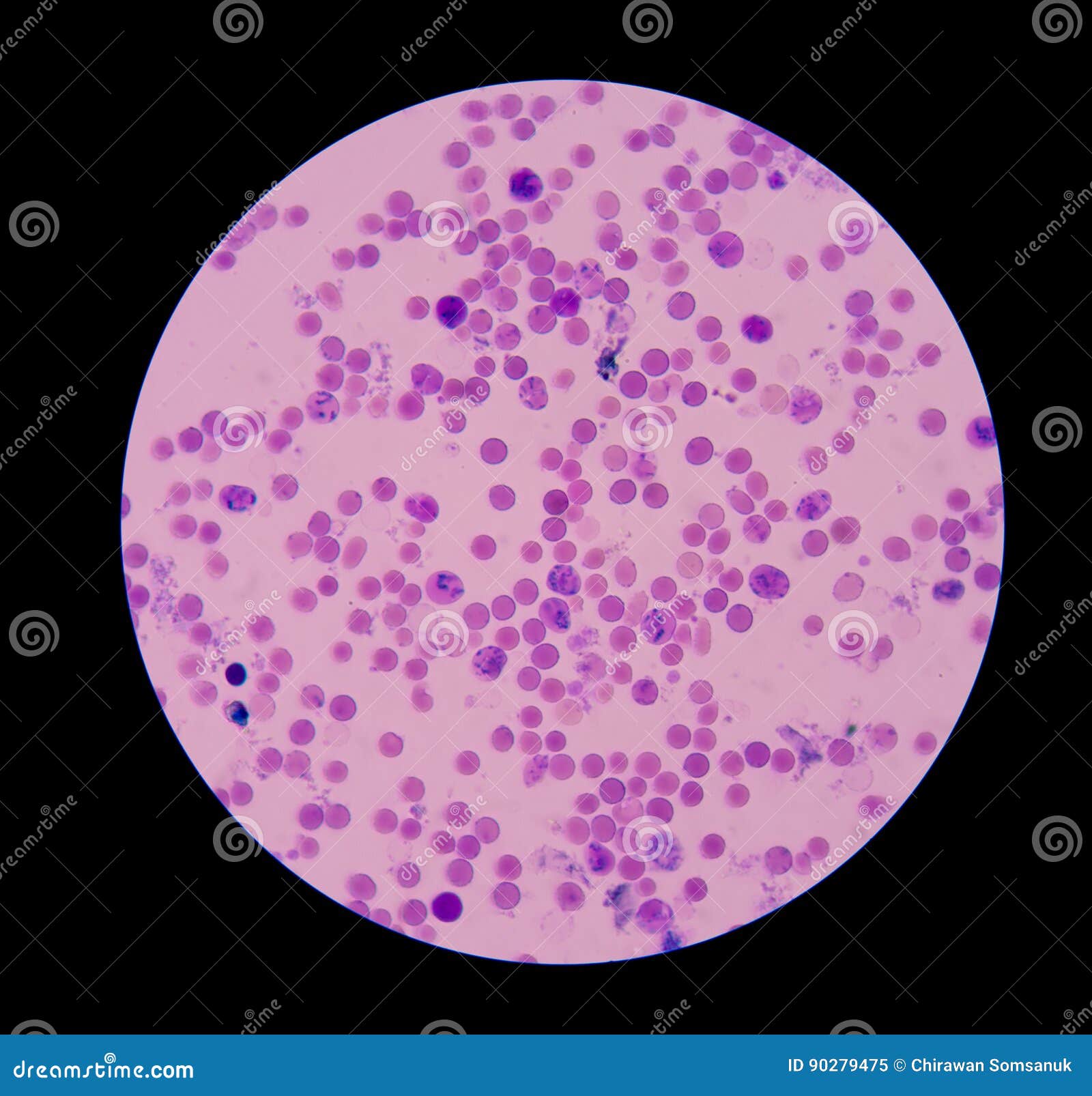 Reticulocyte stock illustration. Illustration of anemia - 90279475