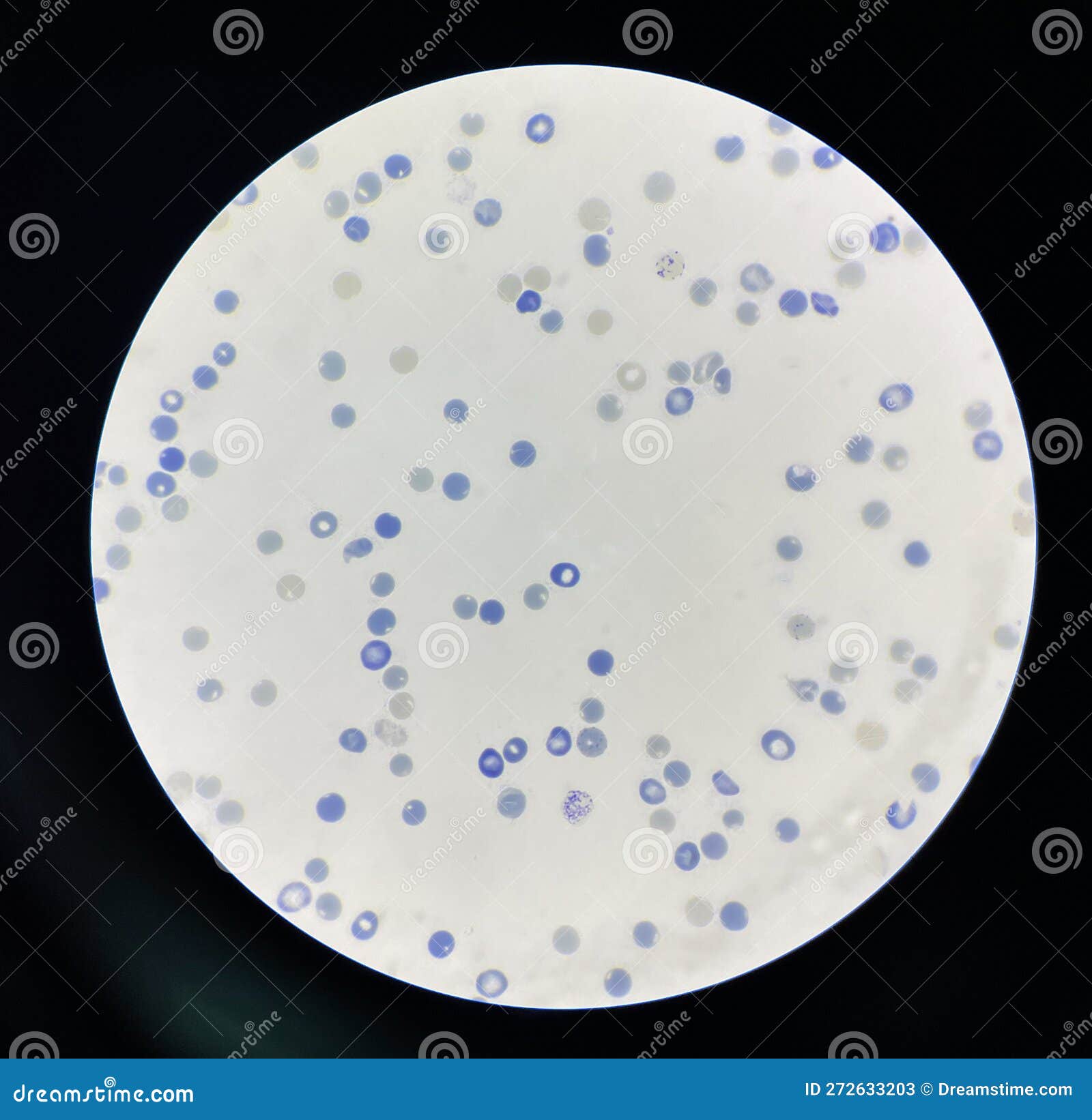 Reticulocytes are Red Blood Cells that are Still Developing Stock Image ...