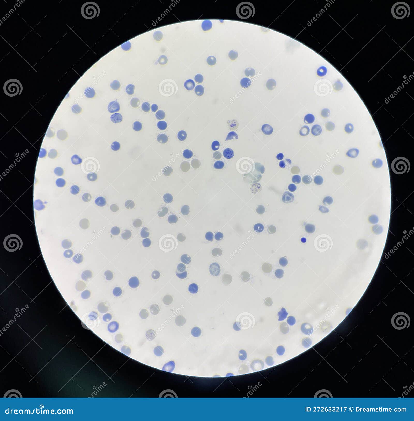 Reticulocytes are Red Blood Cells that are Still Developing Stock Image ...