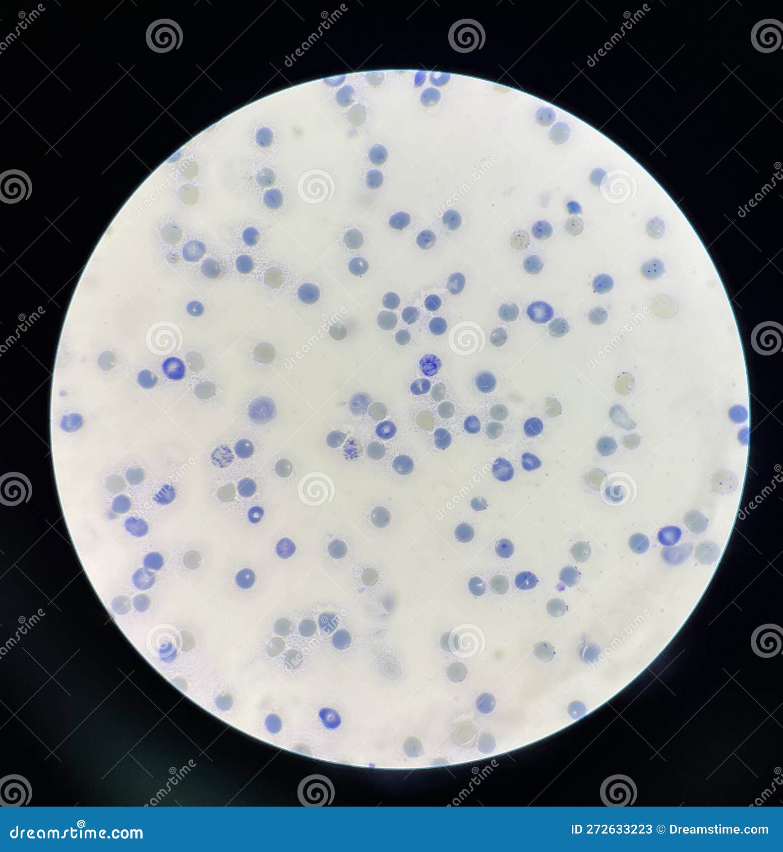 Reticulocyte Count Under Microscope, 40x. Methylene Blue Staining Stock ...