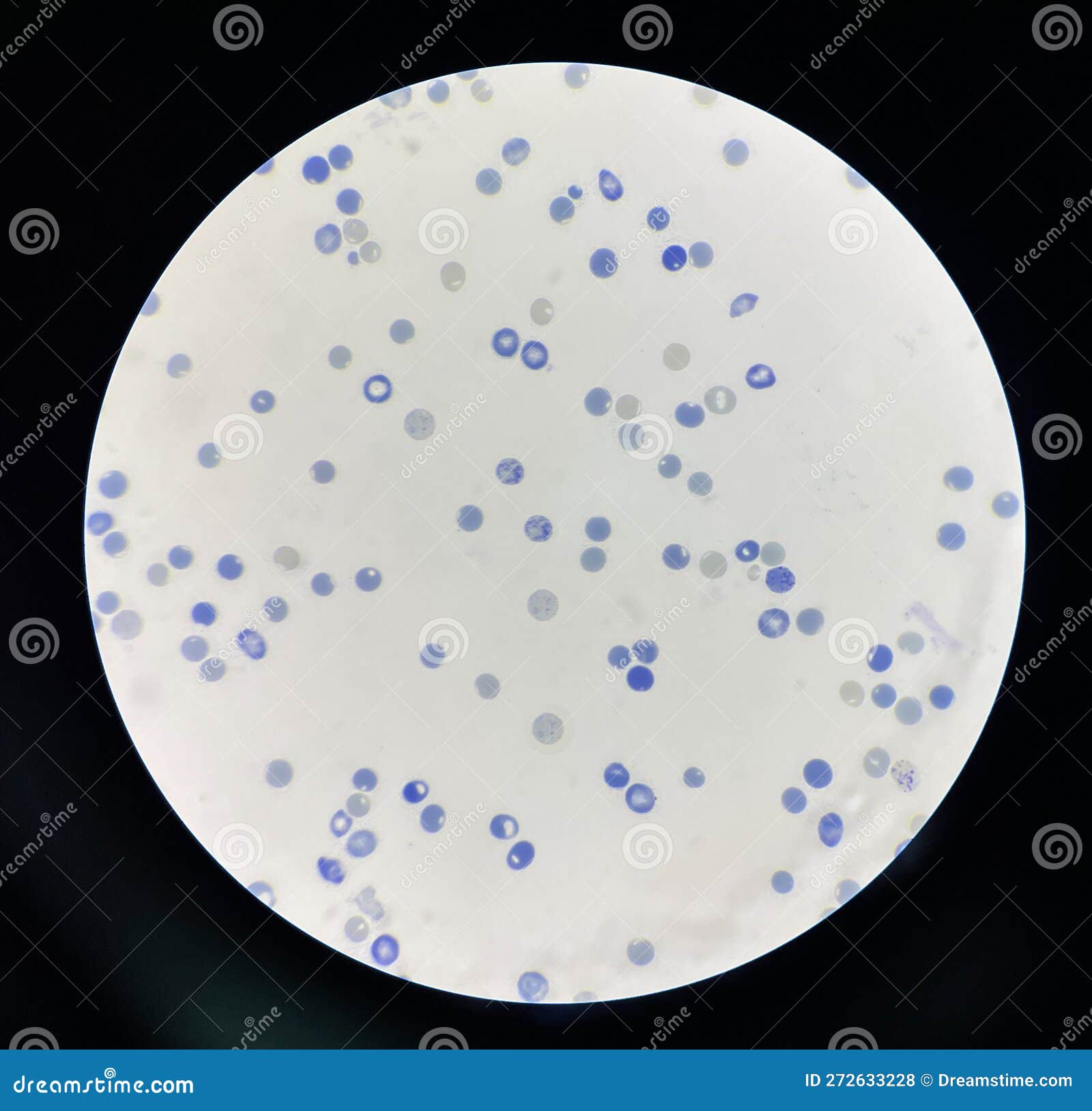 Reticulocyte Count From Blood Smear Hematology. Stock Photo ...