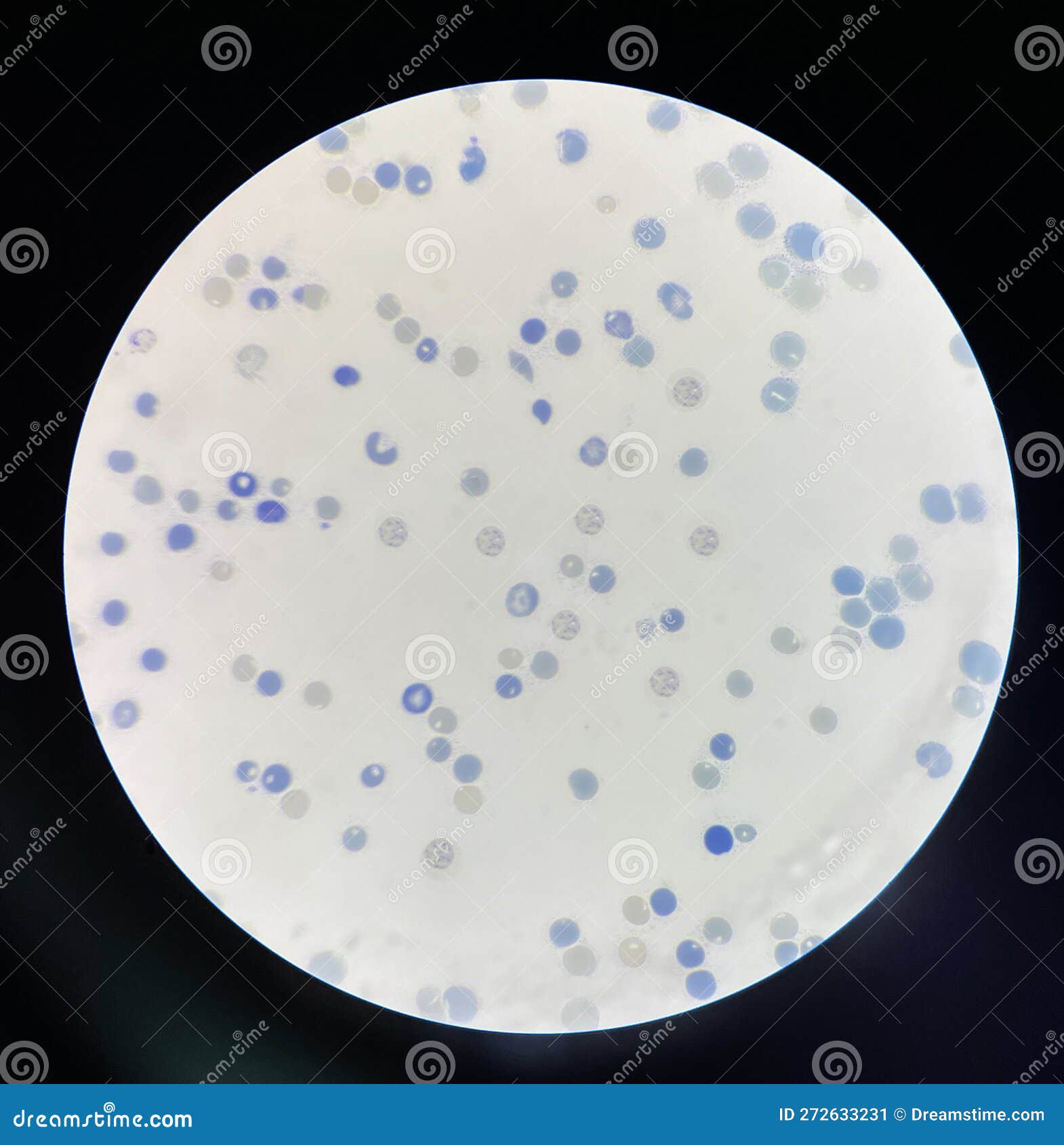 Reticulocyte Count Under Microscope, 40x. Methylene Blue Staining Stock ...