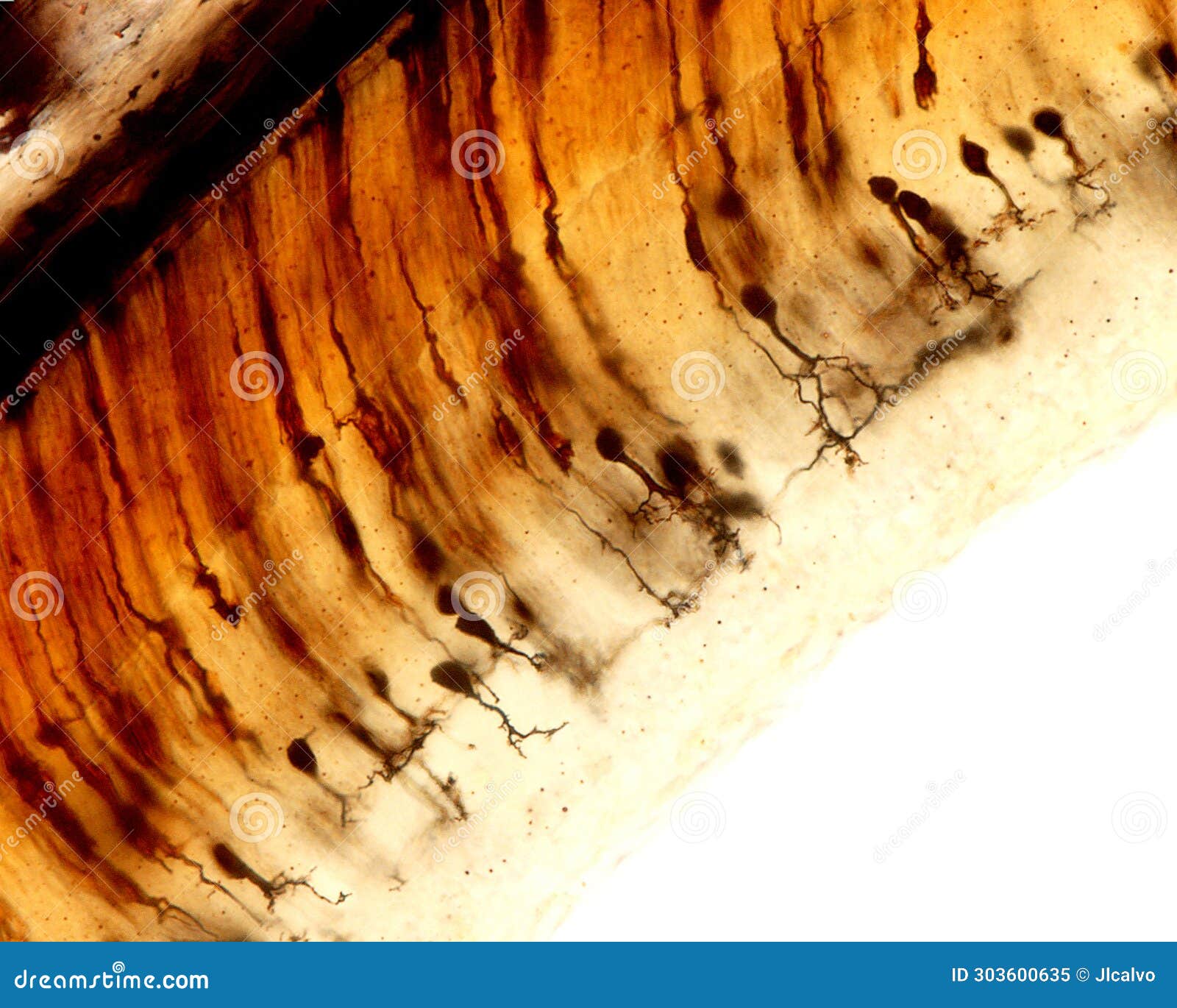 Retina. Golgi Method. Amacrine Cell Stock Image - Image of microscopy ...