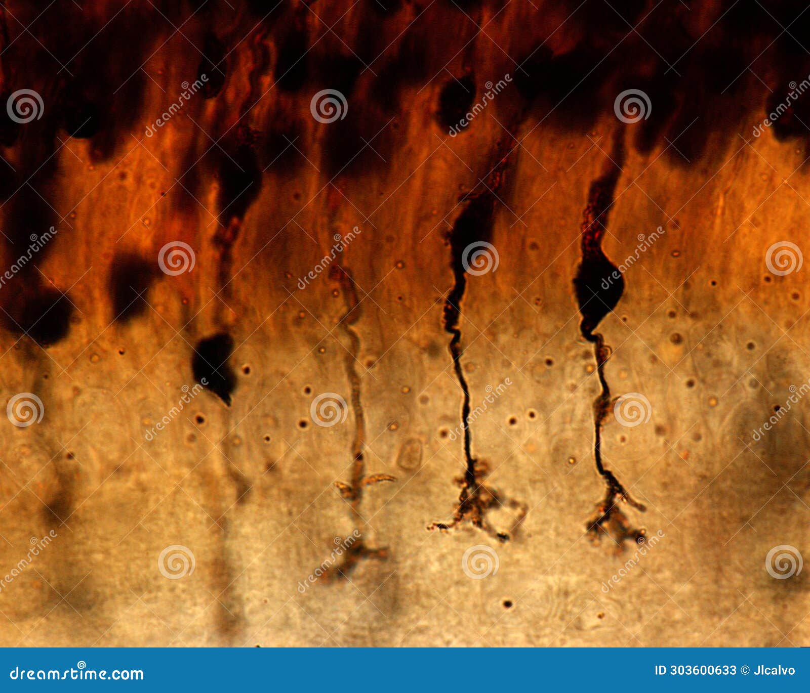 Retina. Golgi Method. Bipolar Cells Stock Image - Image of microscope ...
